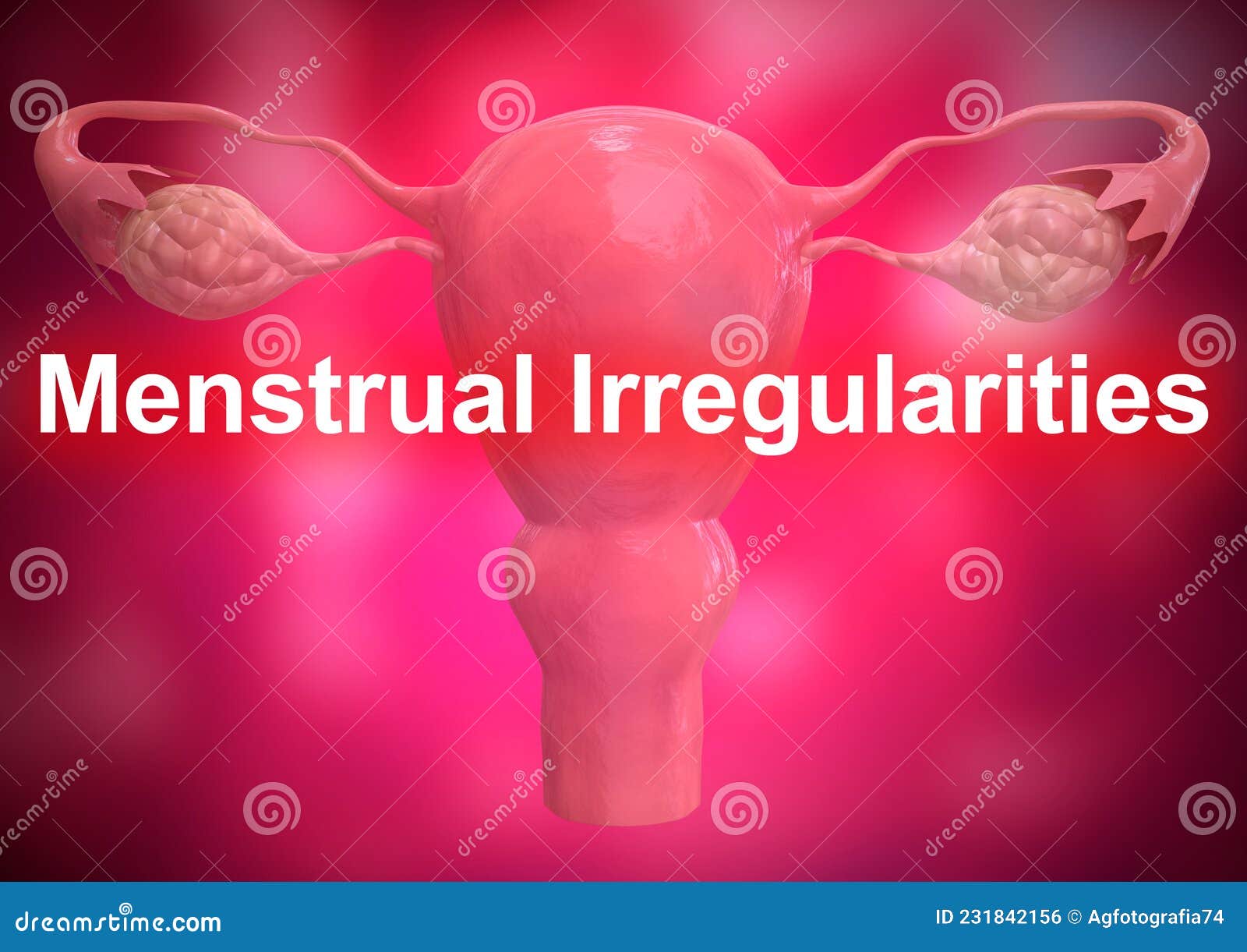 Letter Menstrual Irregularities. Medical Concept of Changing the ...