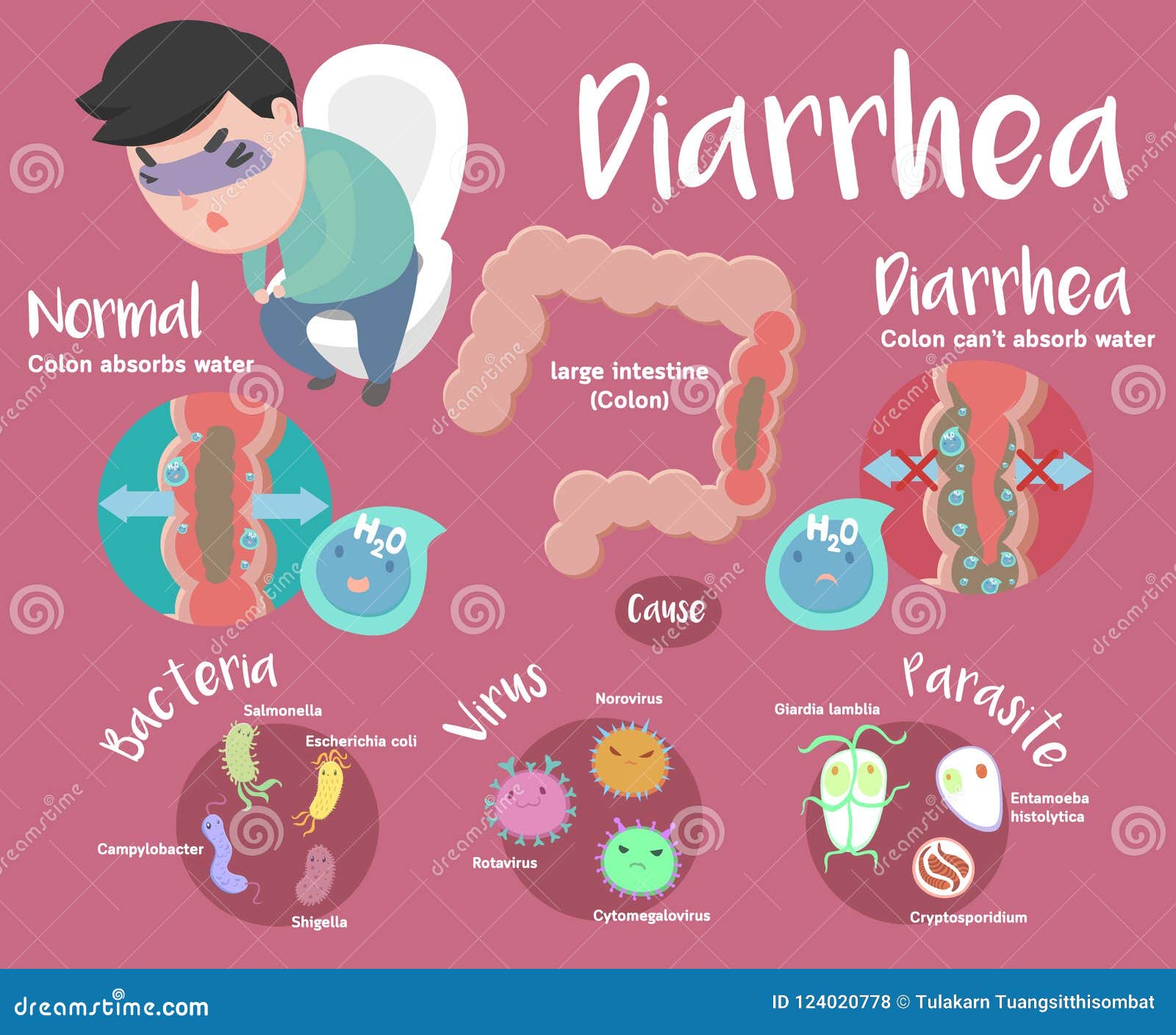 Leuke infographic Diarree vector illustratie. Illustration of ...