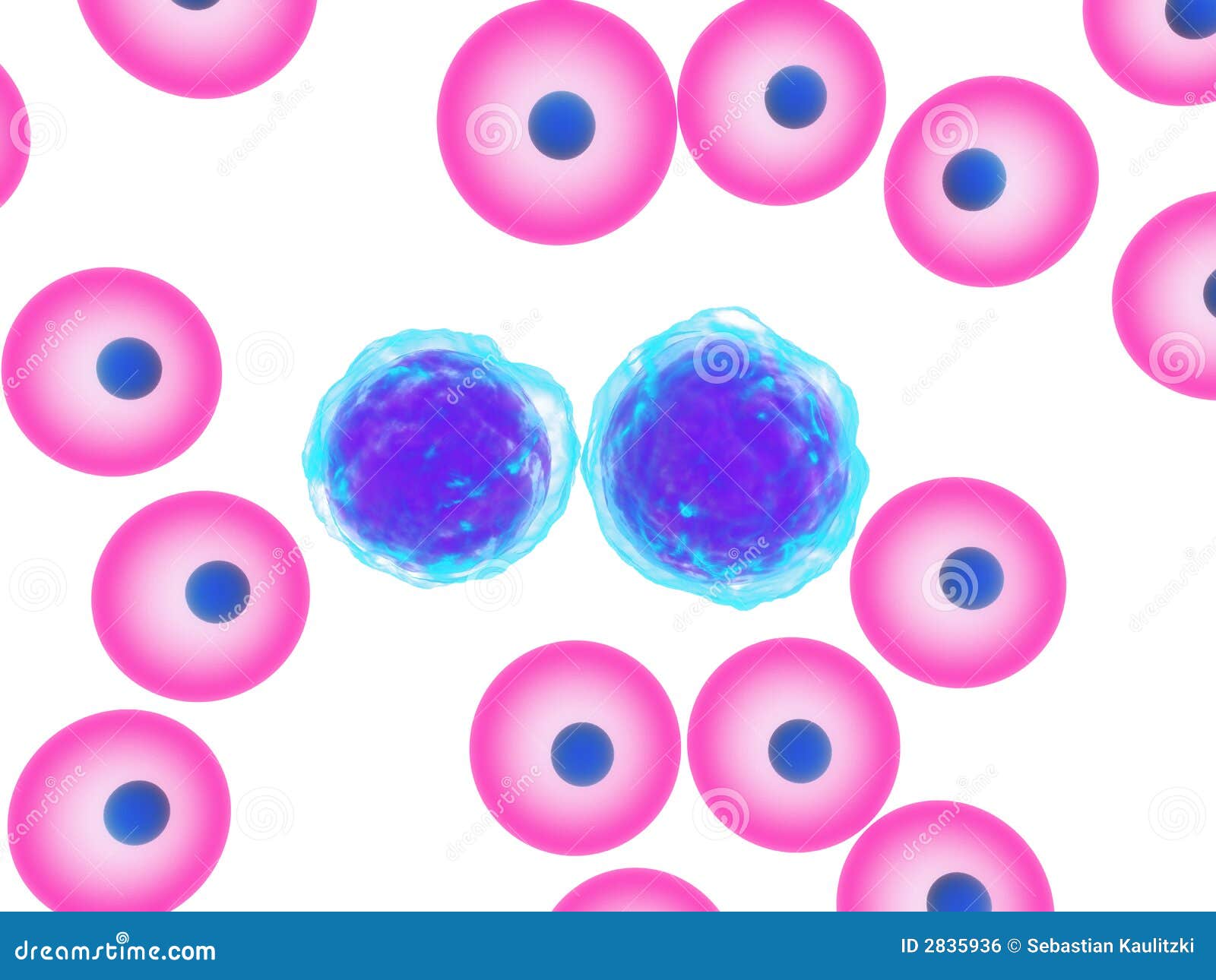 Leukemia stock illustration. Illustration of hemophilia - 2835936