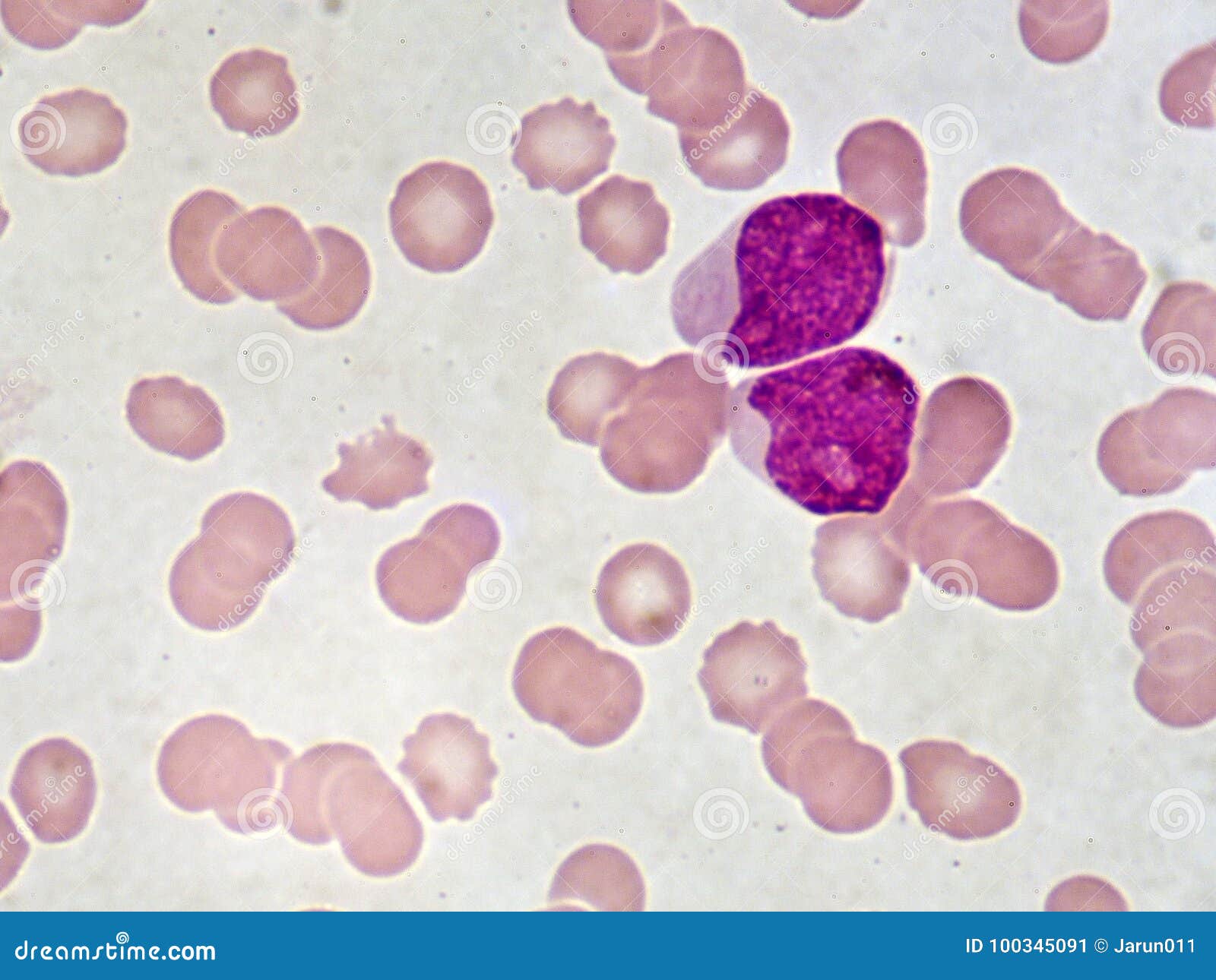 Leukemia cells stock image. Image of analyzing, cell - 100345091