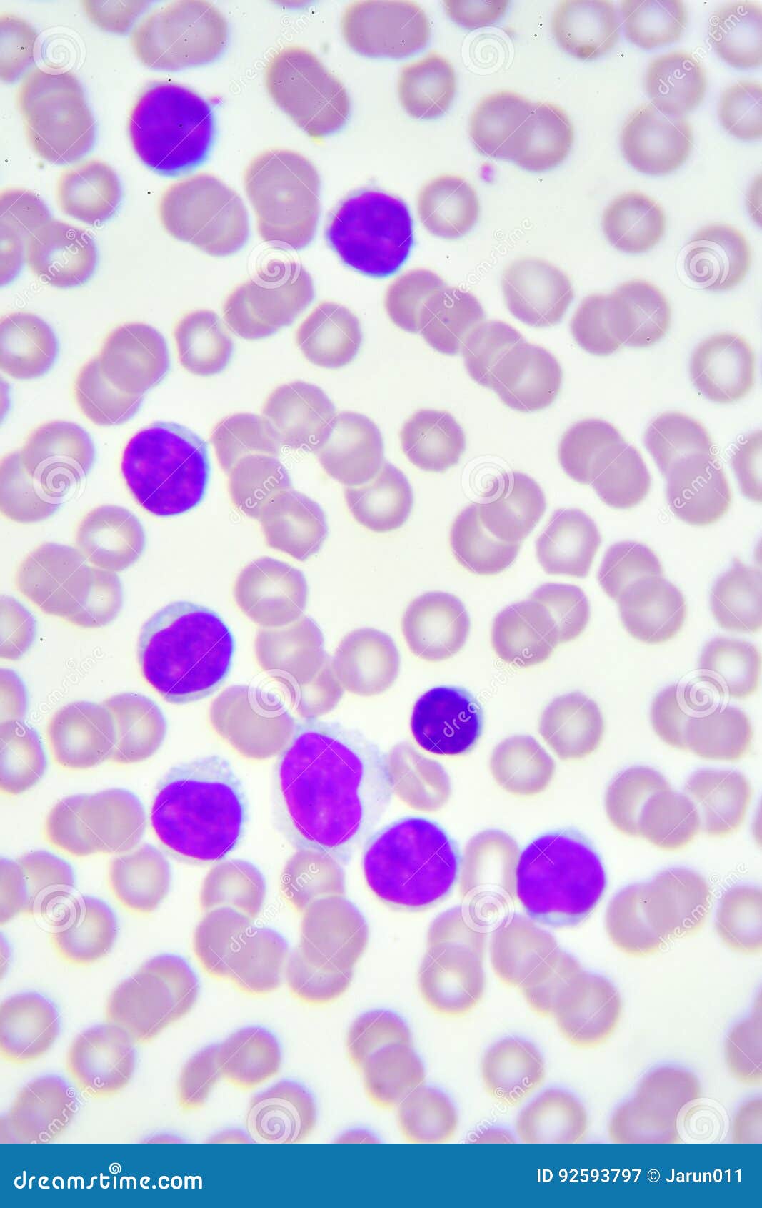 Leukemia Cells Royalty-Free Stock Photo | CartoonDealer.com #92593797