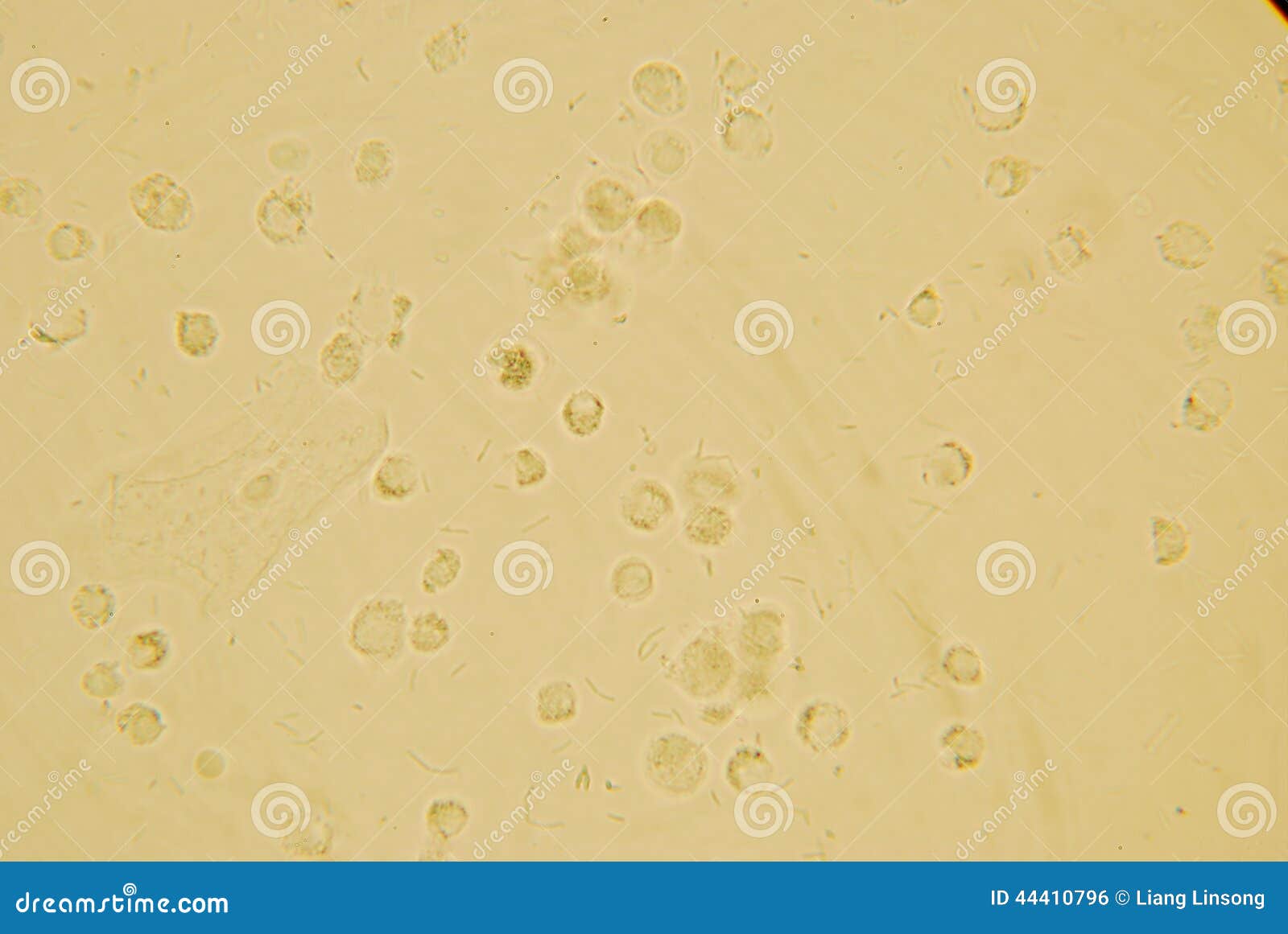 The Leukocyte and Epithelial Under the Microscope Stock Photo - Image ...