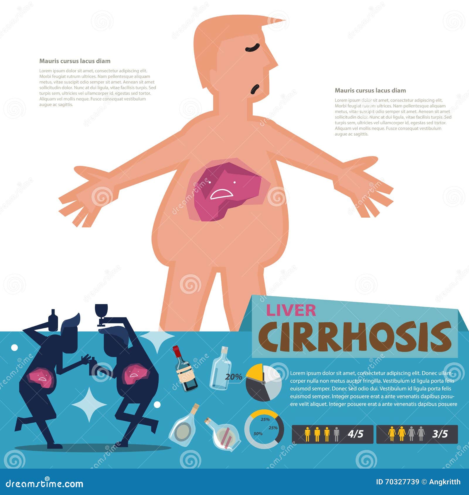 Levercirrose infographic - stock illustratie. Illustration of ...
