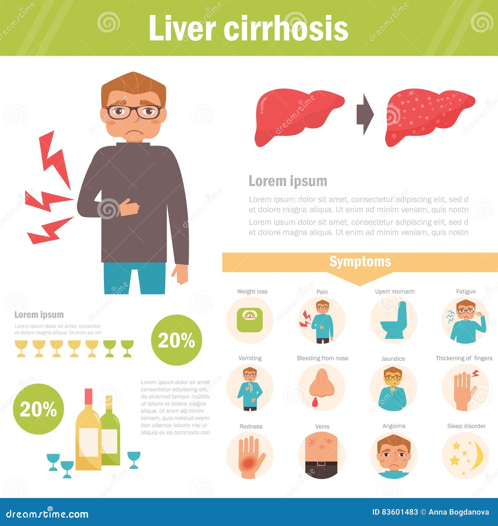Levercirrose Vector vector illustratie. Illustration of hepatitis ...