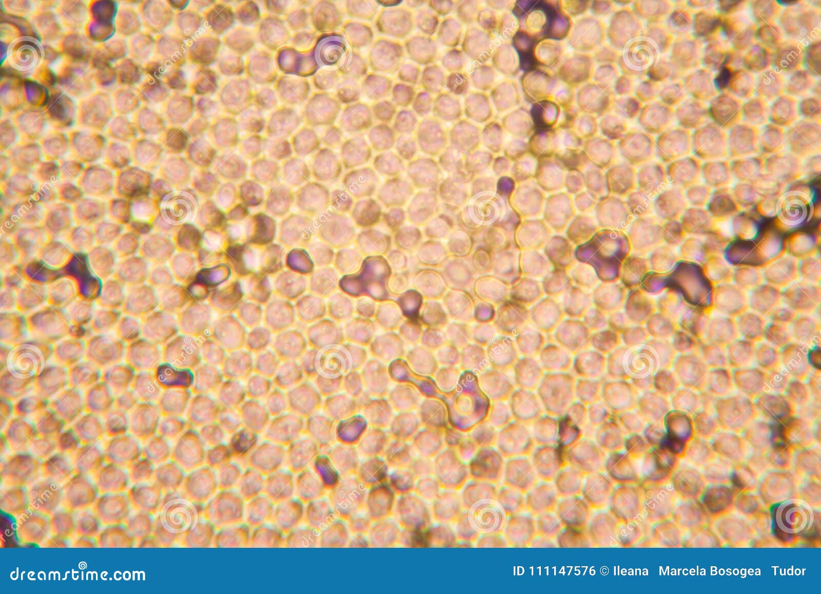 Levure au microscope photo stock. Image du cellule, microscope - 111147576