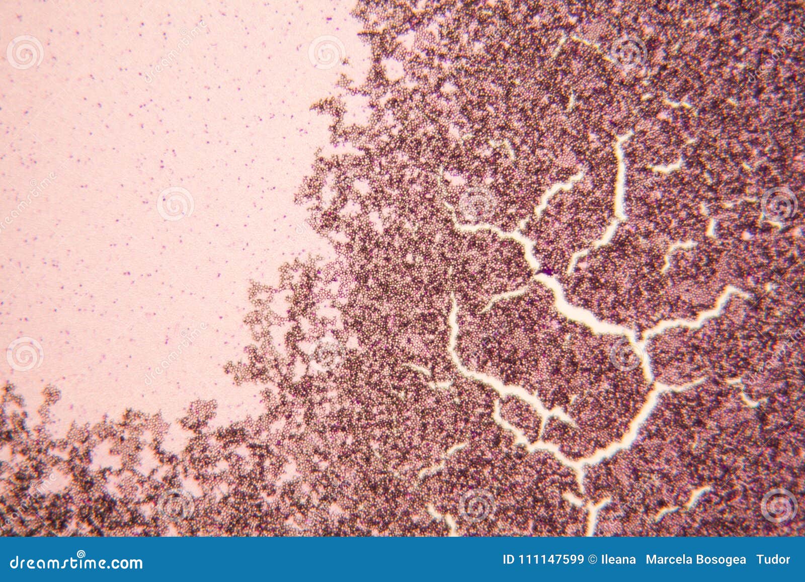 Levure au microscope image stock. Image du champignon - 111147599