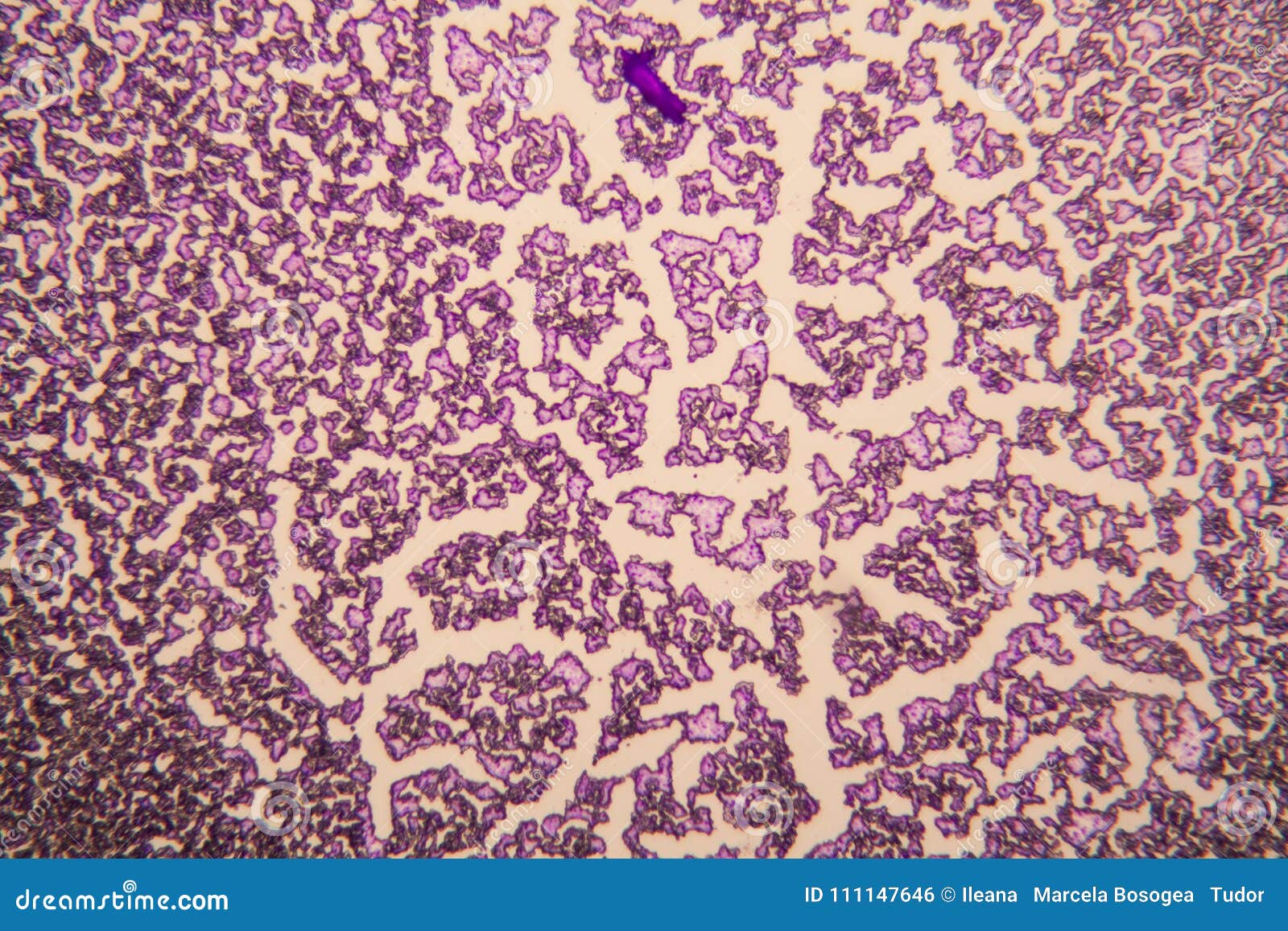 Levure au microscope photo stock. Image of maladie, bourgeonnement ...