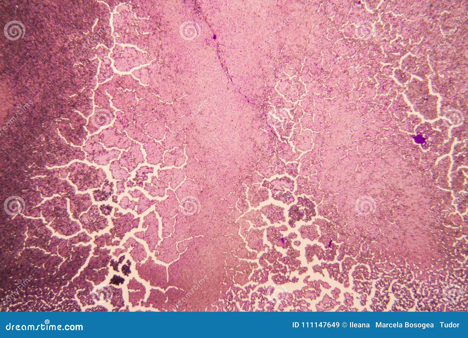 Levure au microscope image stock. Image du microscopique - 111147649