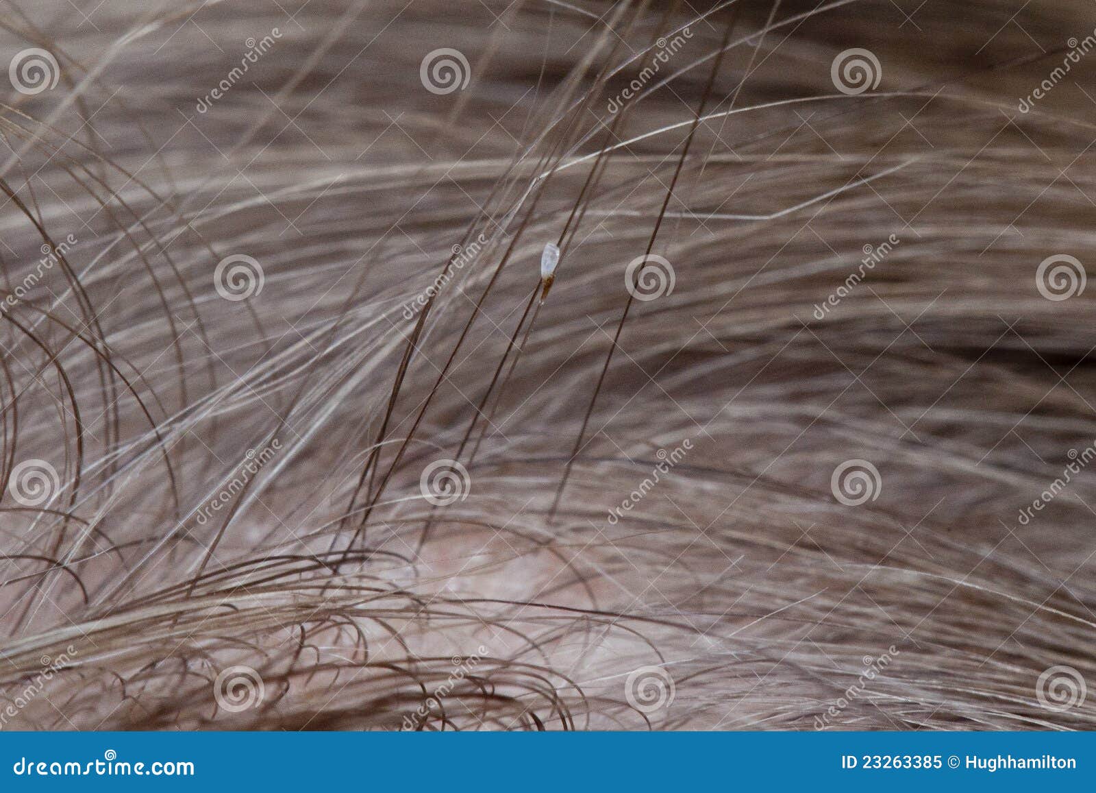 Lice stock image. Image of children, child, line, insects - 23263385