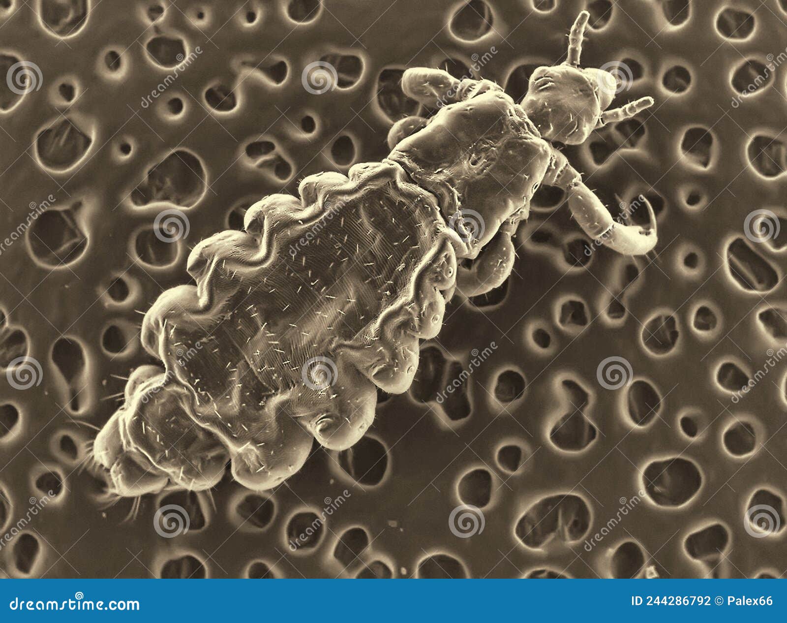 Lice Egg Under A Microscope