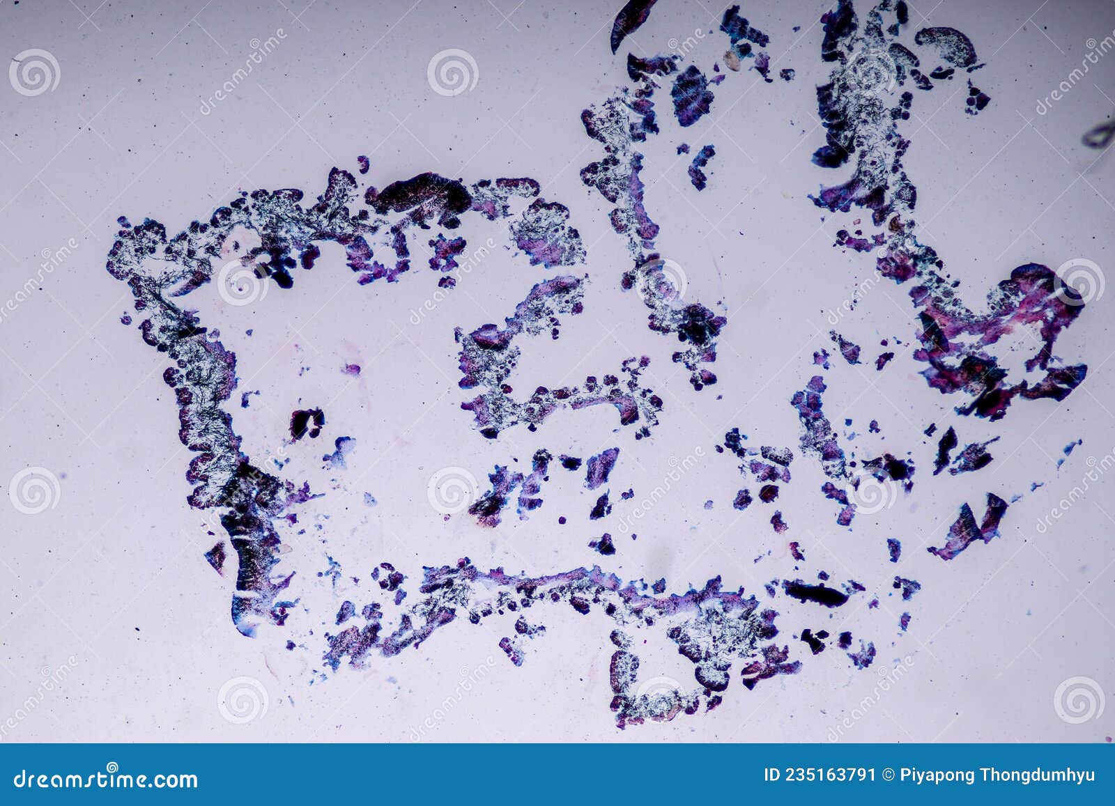 Lichen, Hyphae and Symbiotic Algae Under the Microscope for Education ...