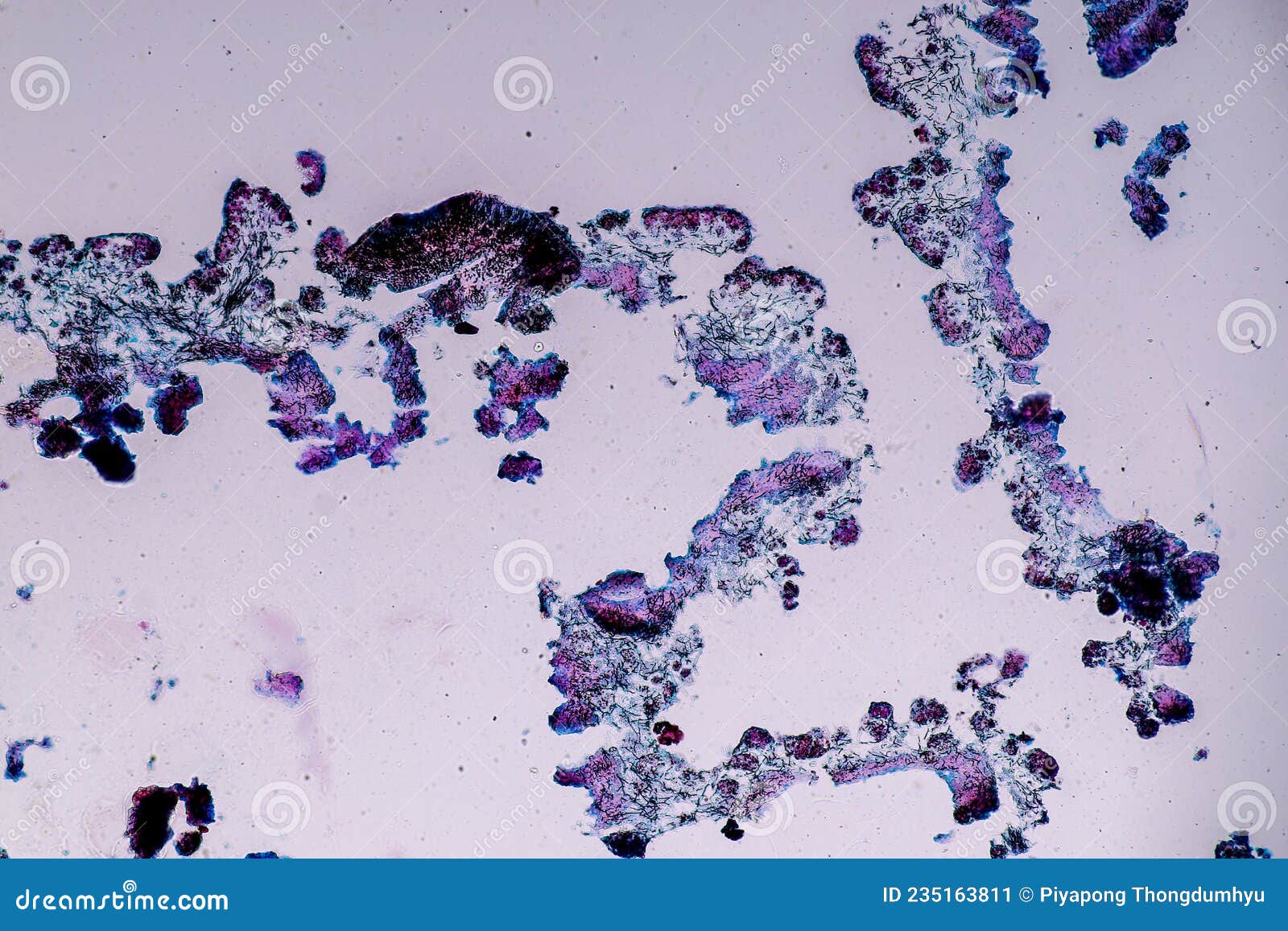 Lichen, Hyphae and Symbiotic Algae Under the Microscope for Education ...
