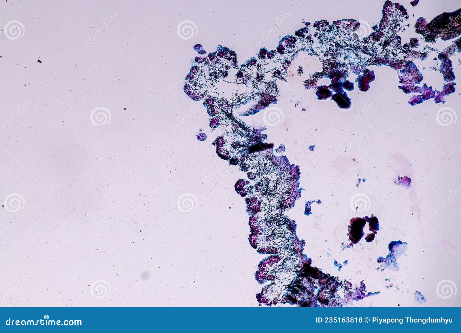 Lichen, Hyphae and Symbiotic Algae Under the Microscope for Education ...