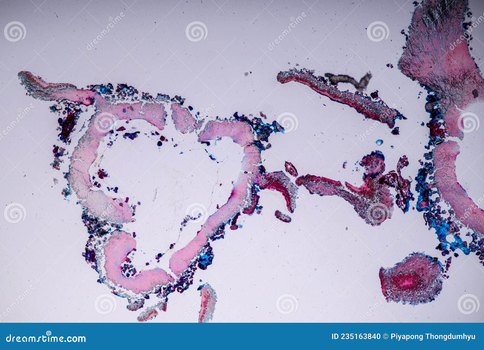 Lichen, Hyphae and Symbiotic Algae Under the Microscope for Education ...
