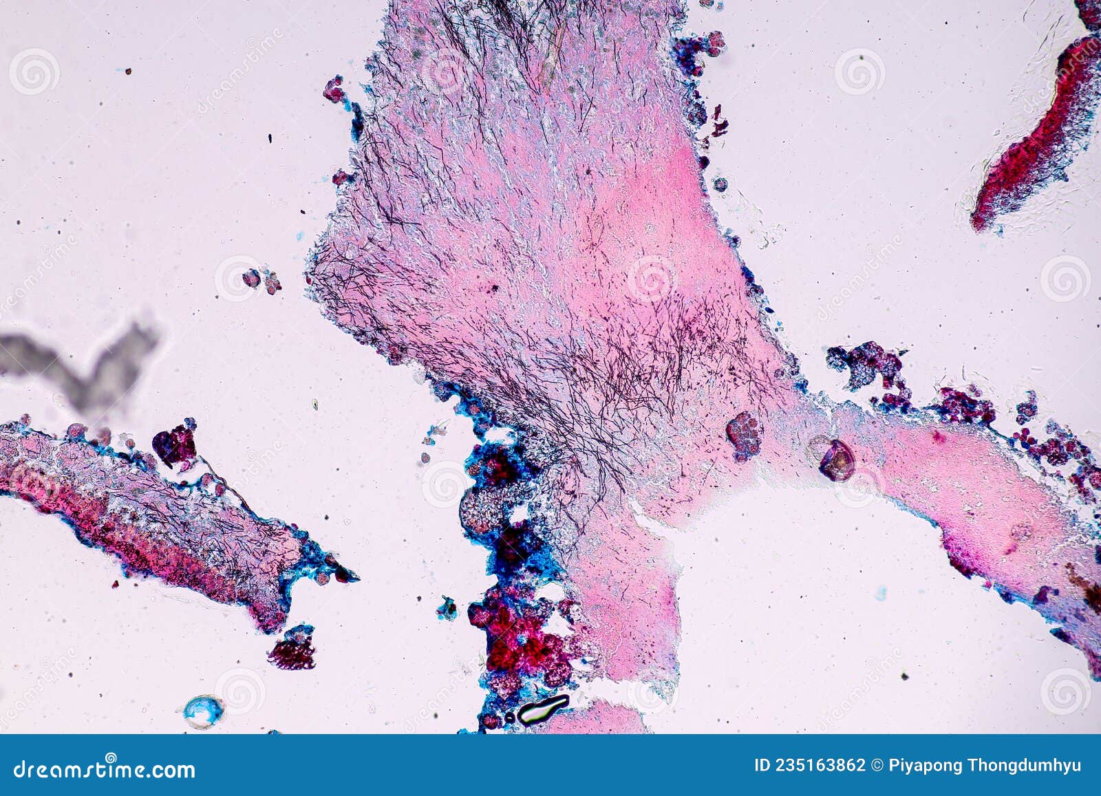 Lichen, Hyphae and Symbiotic Algae Under the Microscope for Education ...