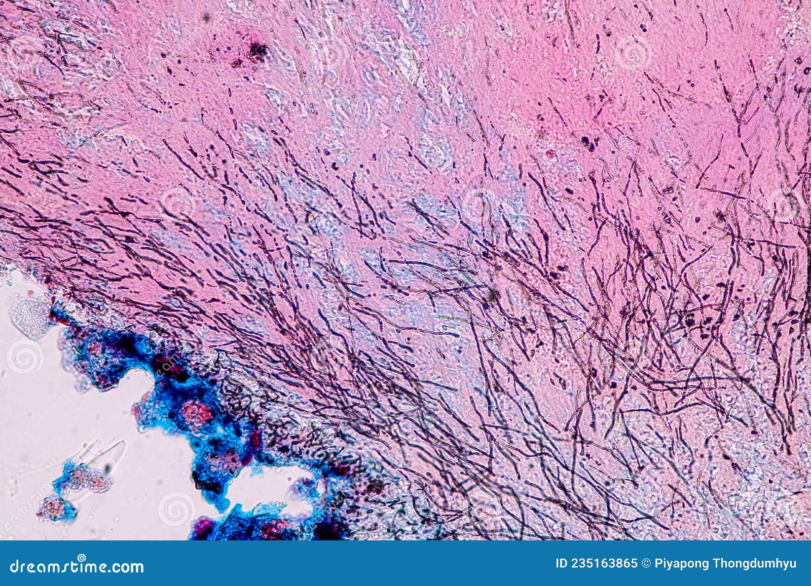 Lichen, Hyphae and Symbiotic Algae Under the Microscope for Education ...