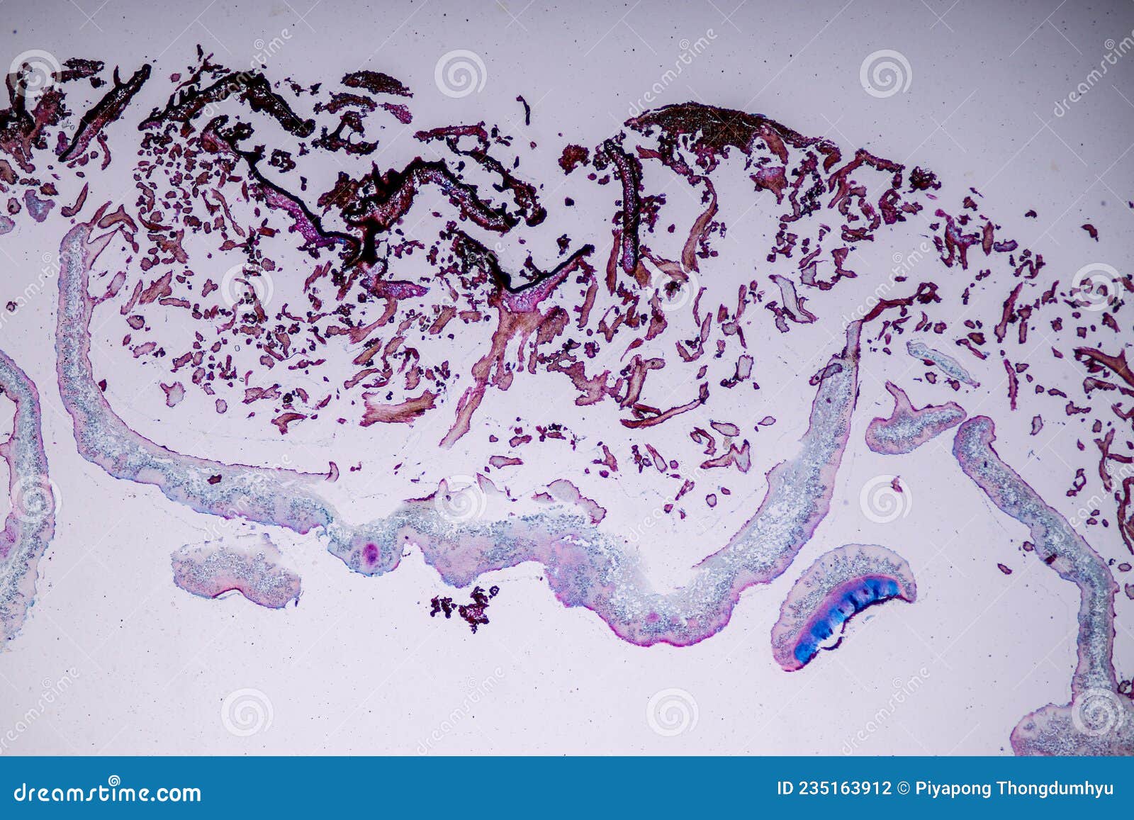 Lichen, Hyphae and Symbiotic Algae Under the Microscope for Education ...