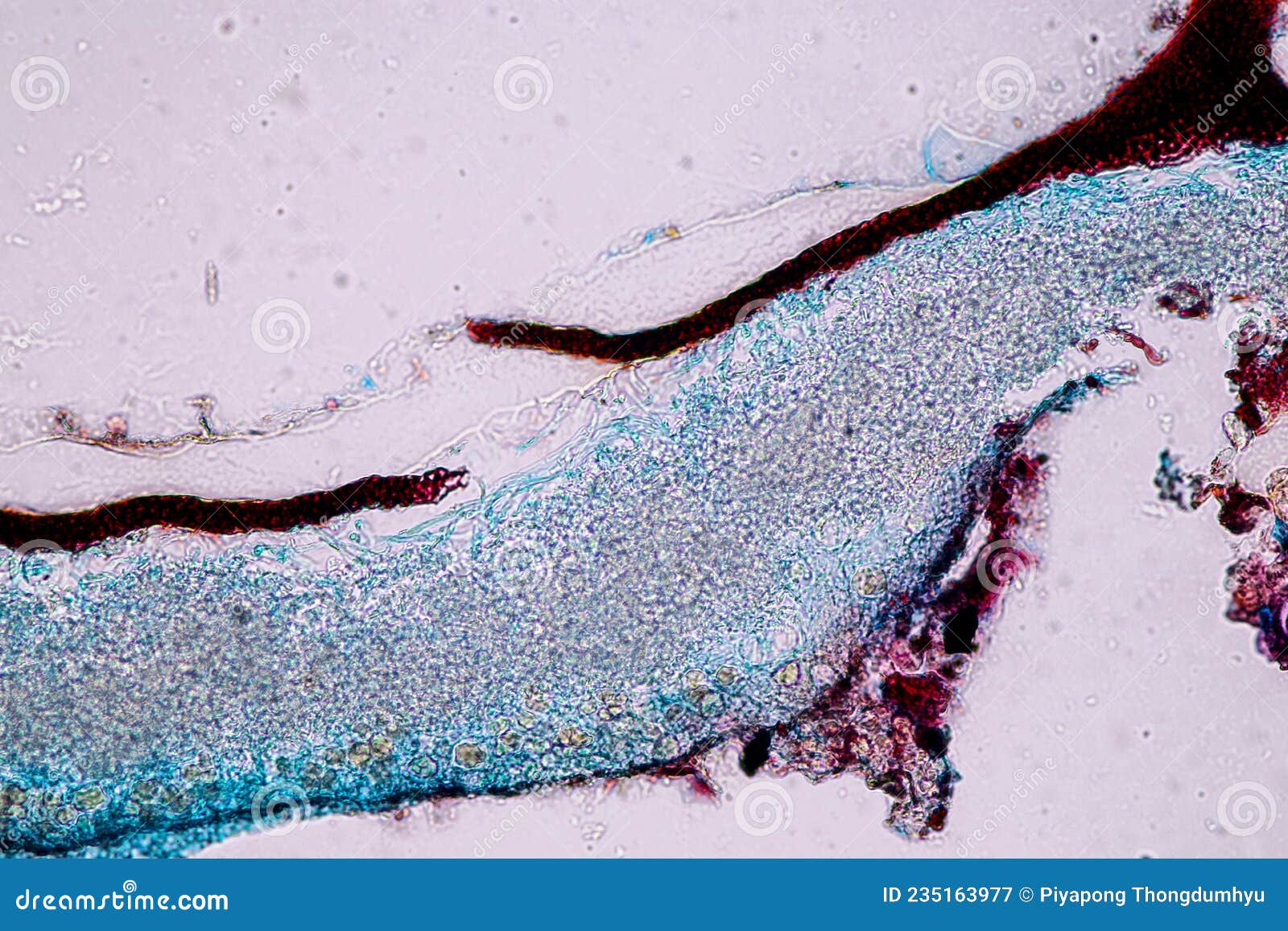 Lichen, Hyphae and Symbiotic Algae Under the Microscope for Education ...