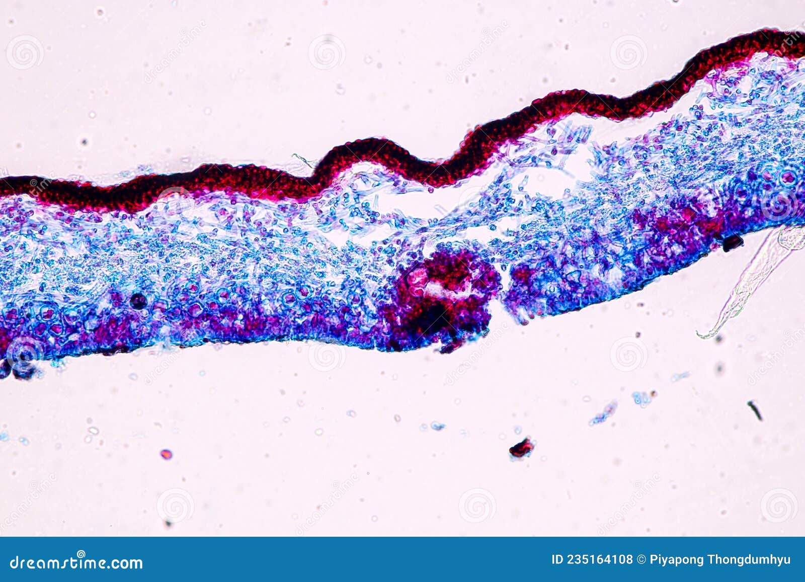 Lichen Thallus Cross Section