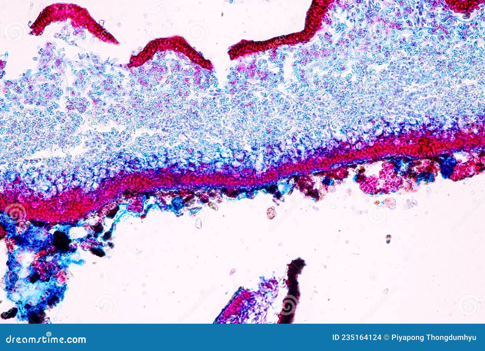 Lichen, Hyphae and Symbiotic Algae Under the Microscope for Education ...