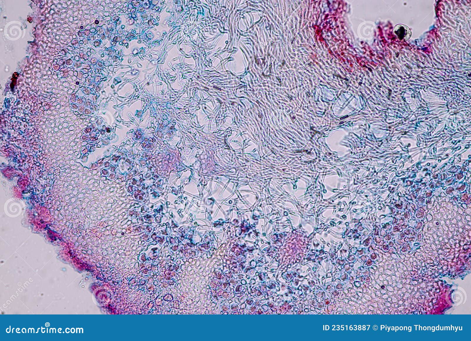 Lichen, Hyphae and Symbiotic Algae Under the Microscope for Education ...