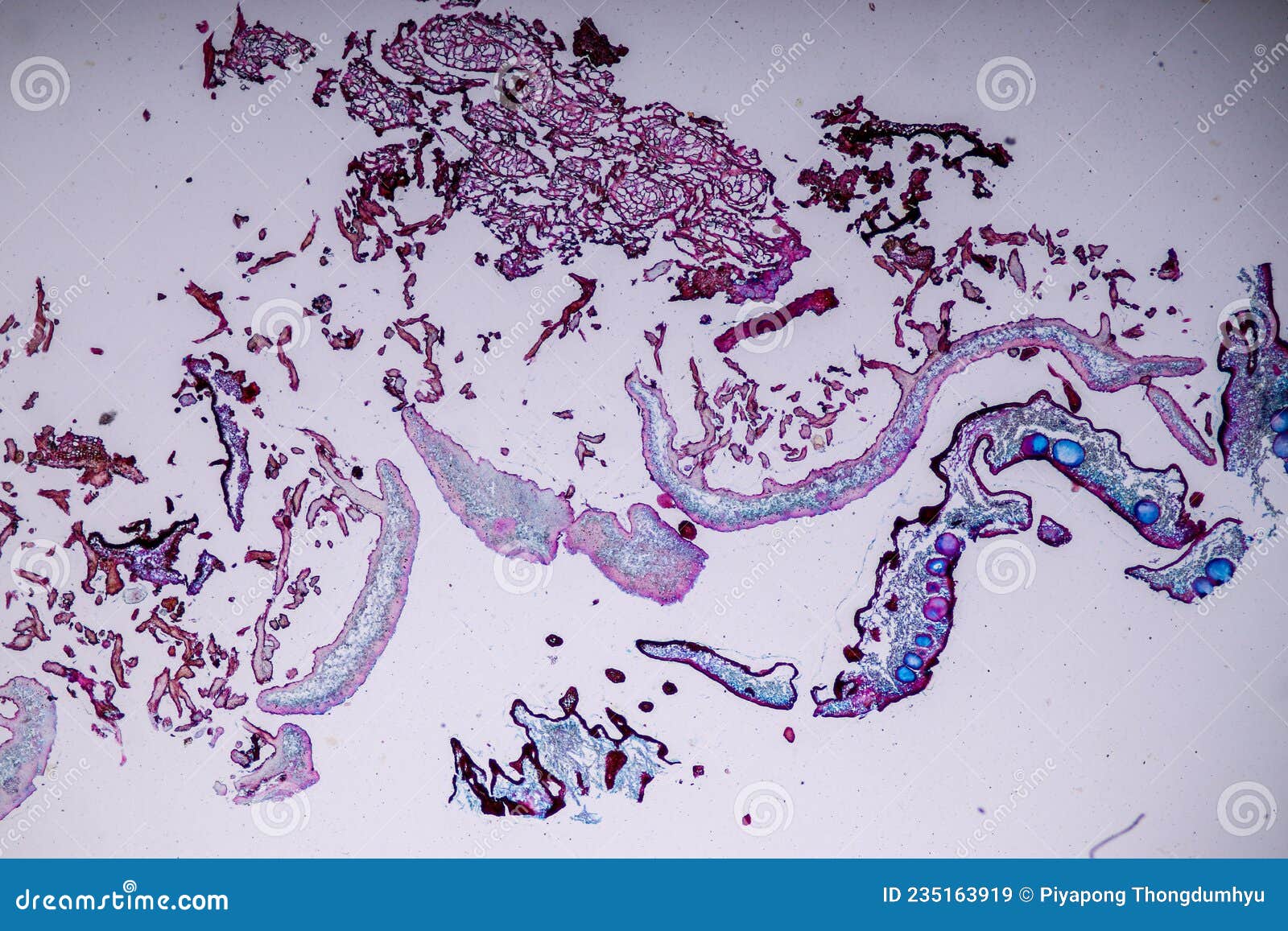 Lichen, Hyphae and Symbiotic Algae Under the Microscope for Education ...