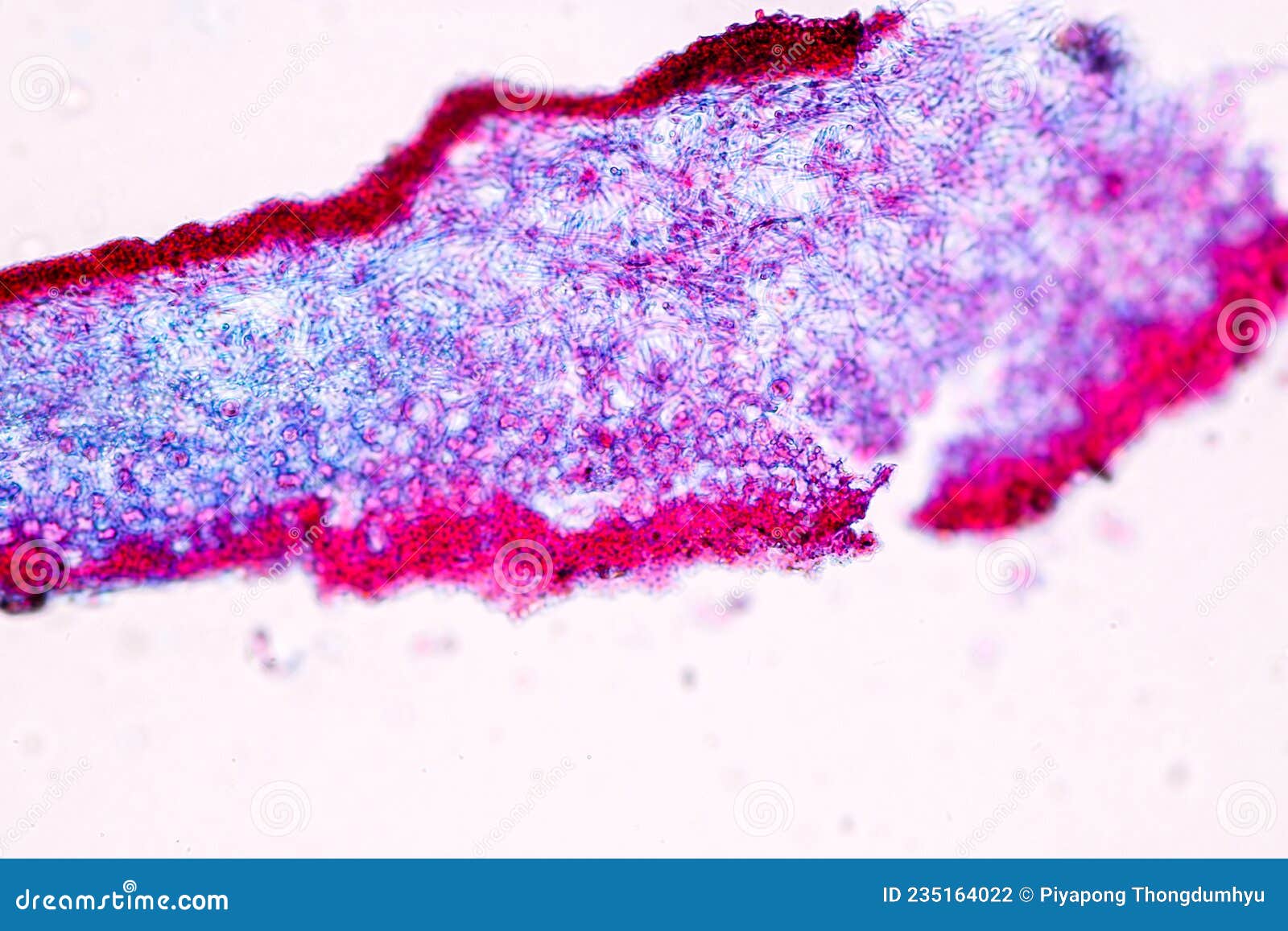 Lichen, Hyphae and Symbiotic Algae Under the Microscope for Education ...