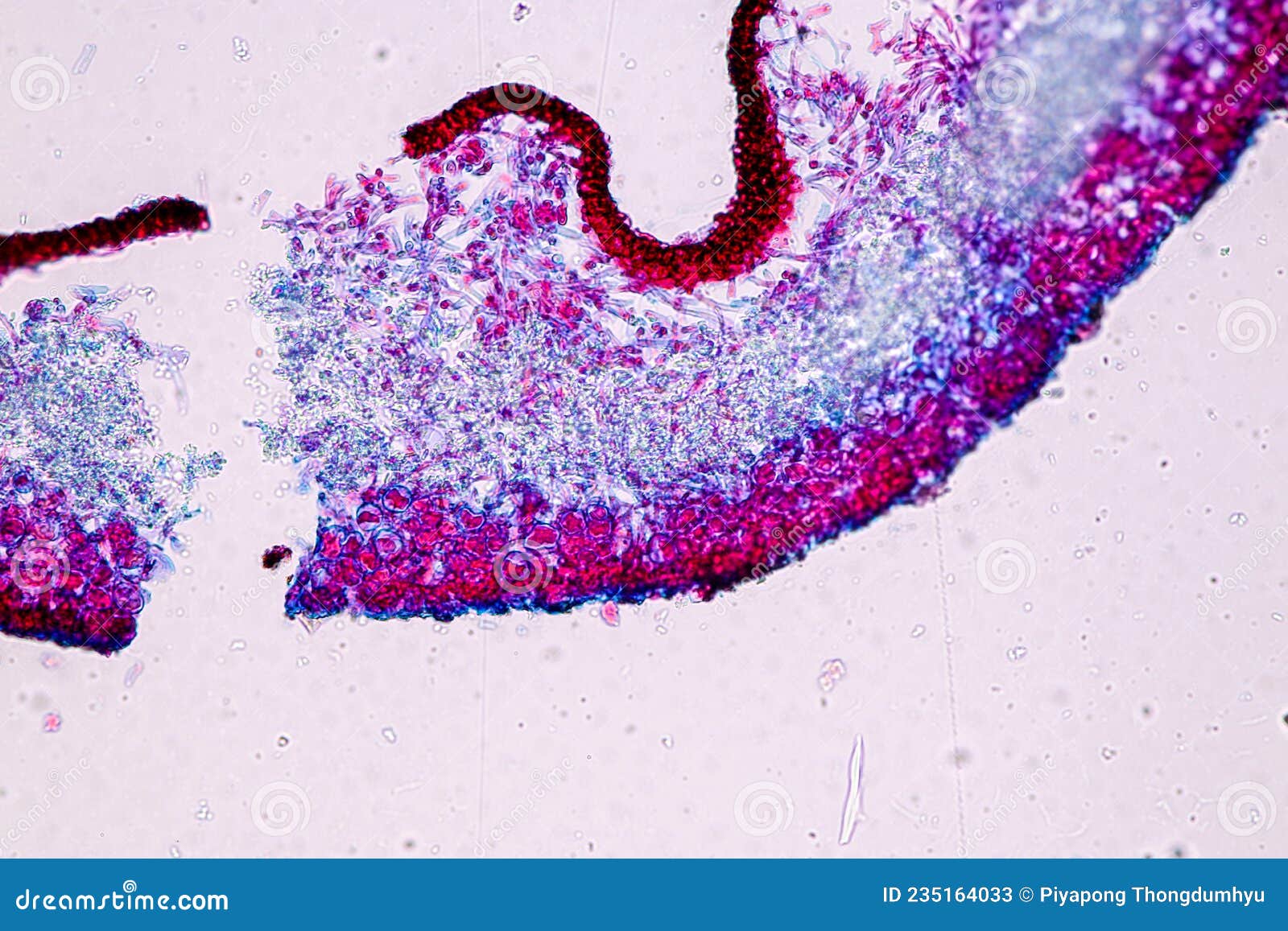 Lichen Under Microscope