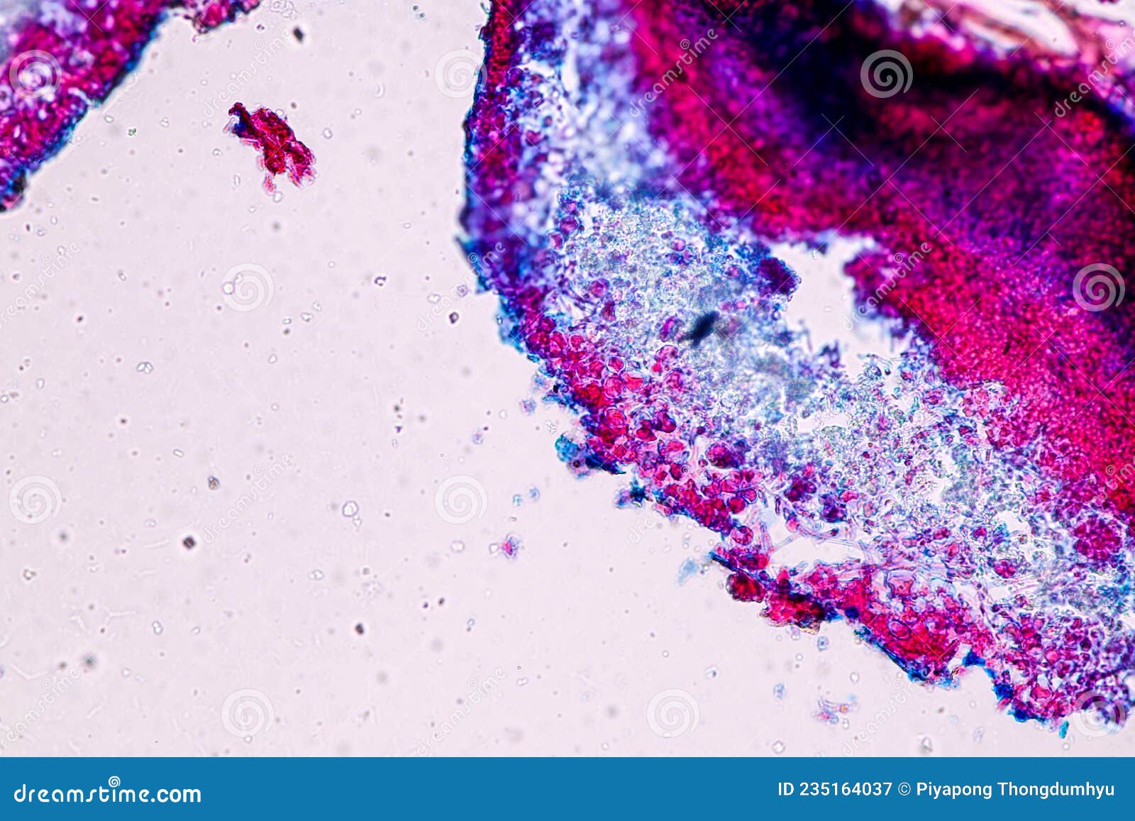 Lichen, Hyphae and Symbiotic Algae Under the Microscope for Education ...