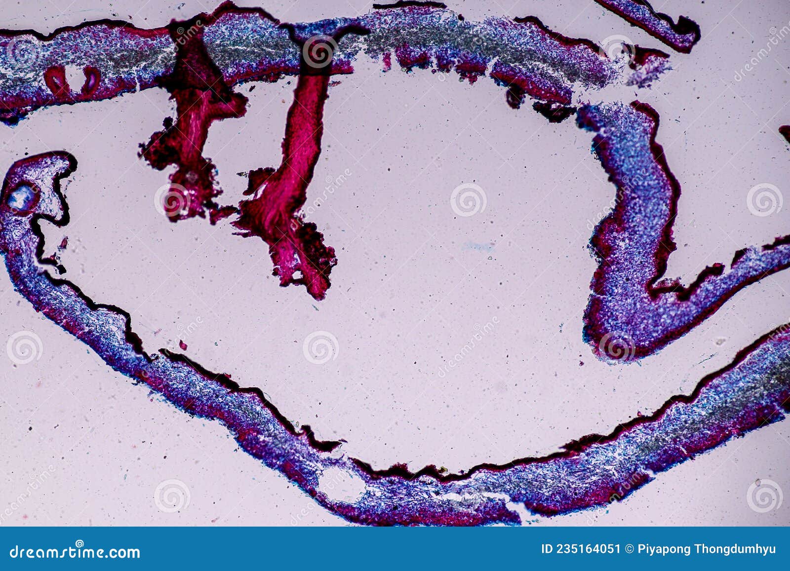 Lichen, Hyphae and Symbiotic Algae Under the Microscope for Education ...