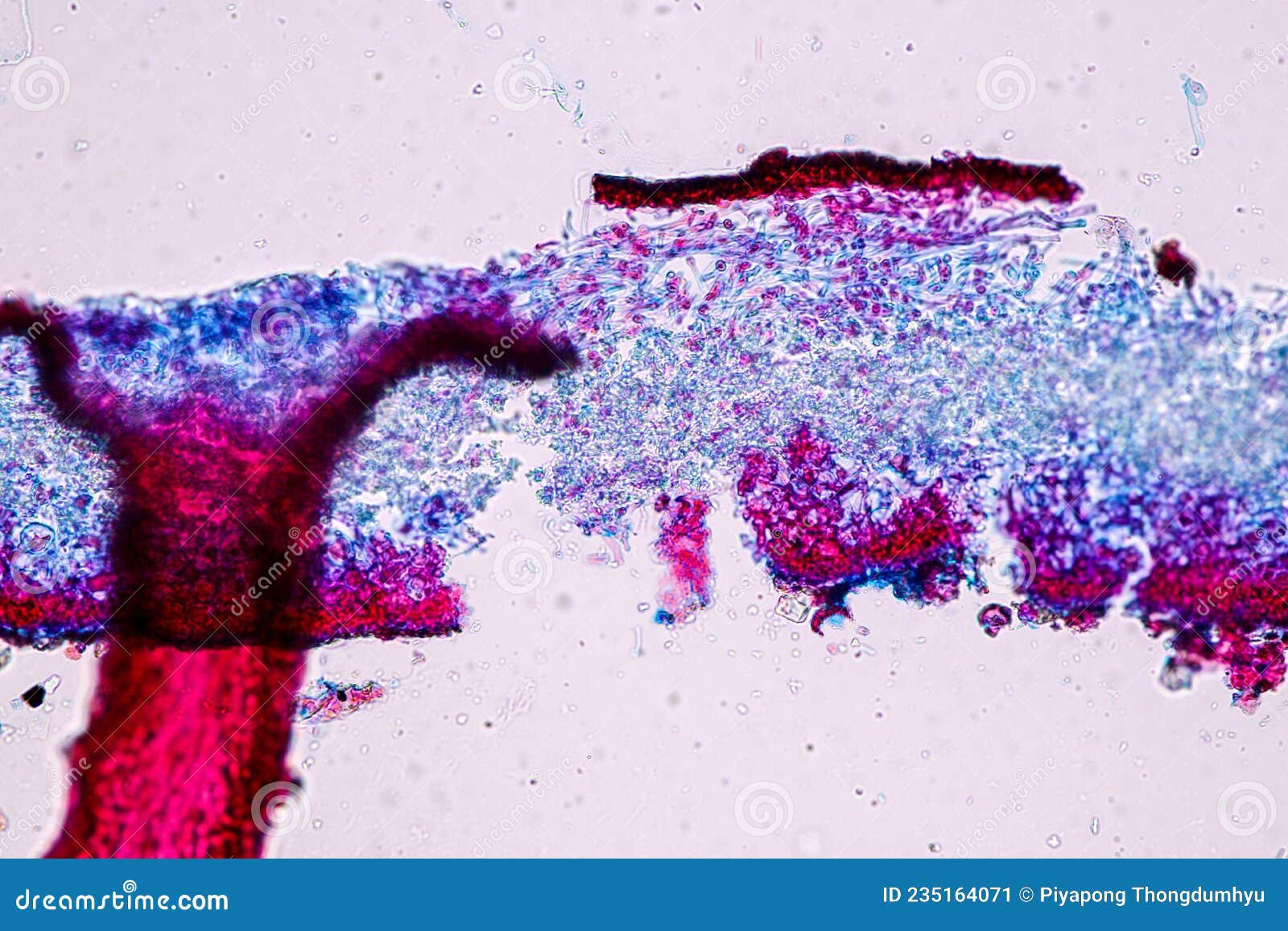 Lichen, Hyphae and Symbiotic Algae Under the Microscope for Education ...