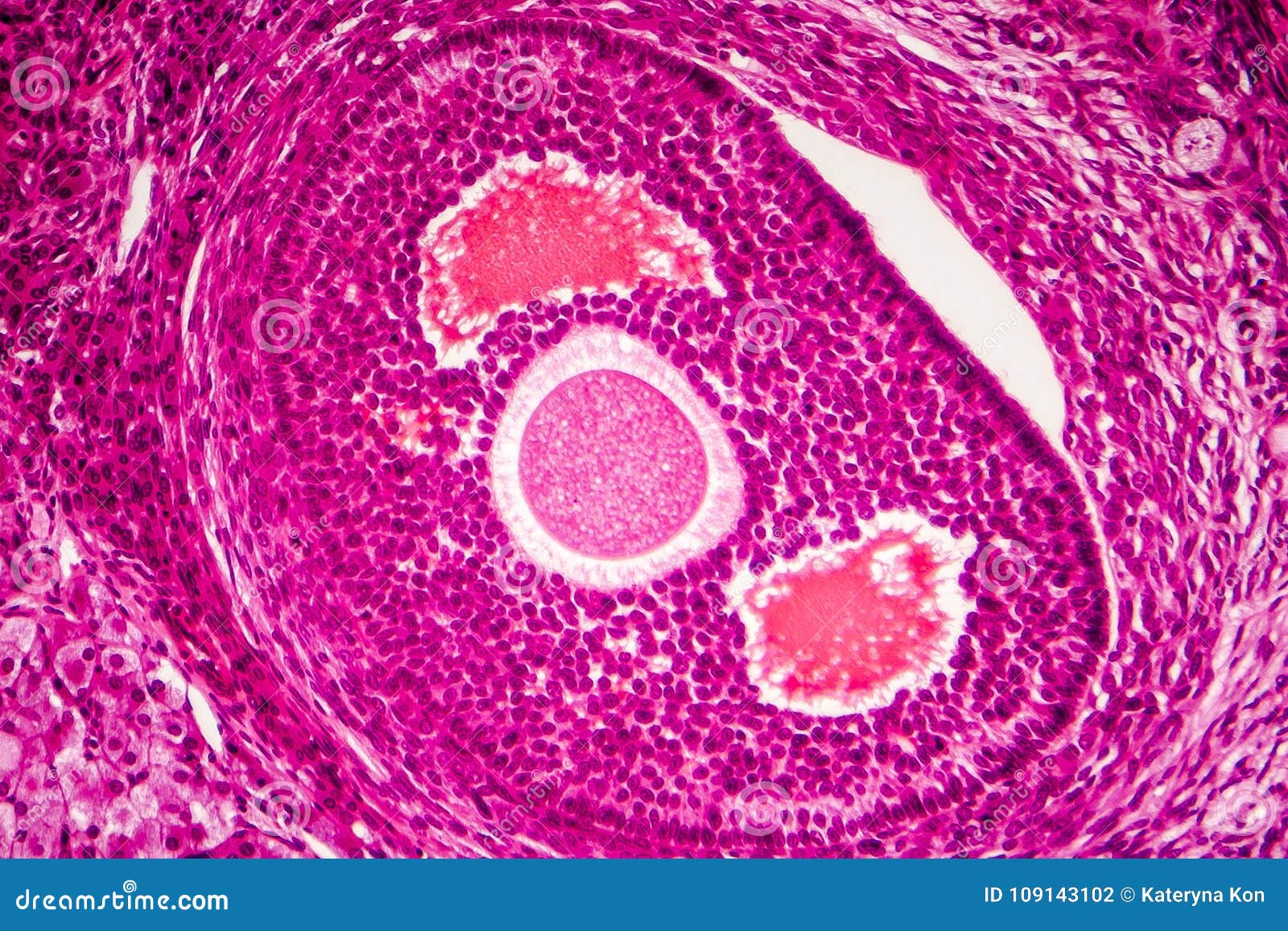 Lichte Micrograaf Van Menselijke Eierstok Stock Foto - Image of ...