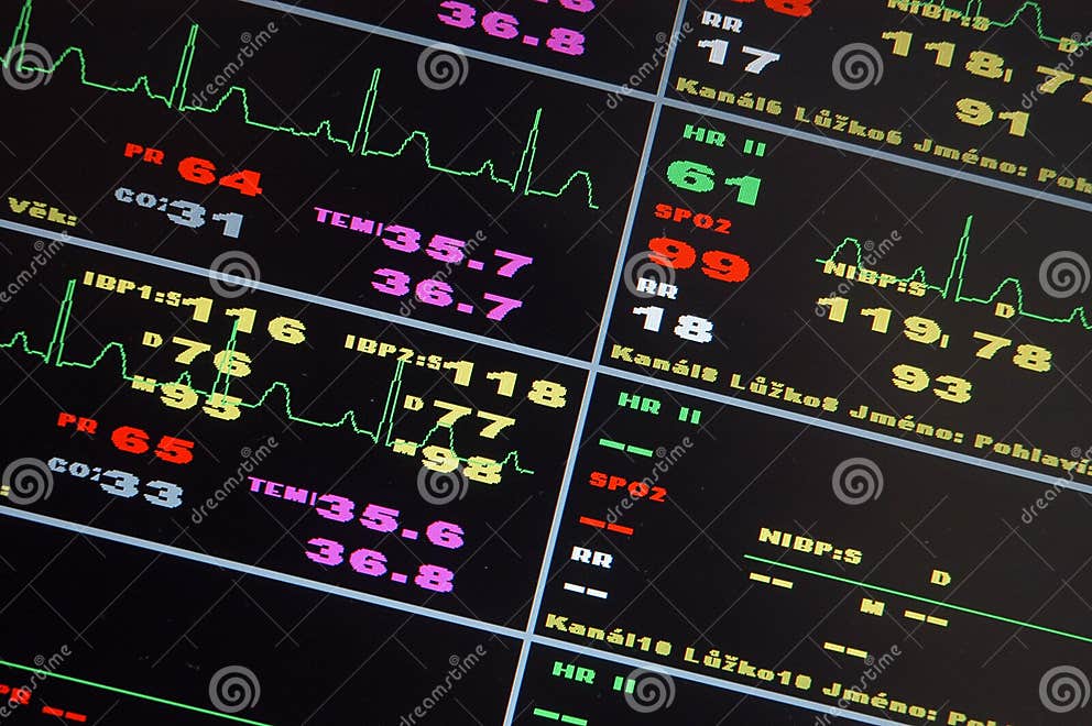 Life functions monitor stock image. Image of monitor, doctor - 3298629