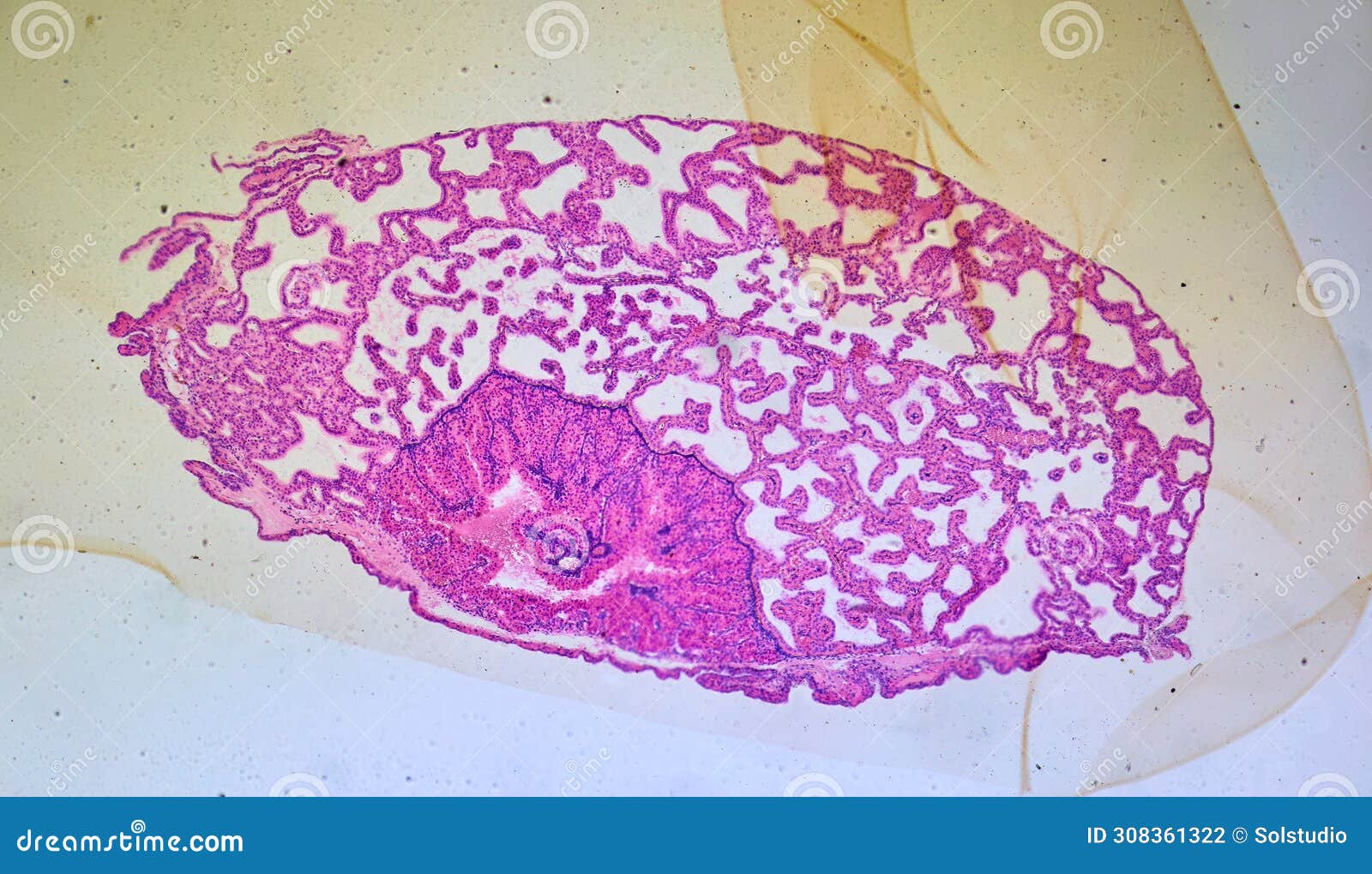 Life under a microscope stock photo. Image of micro - 308361322