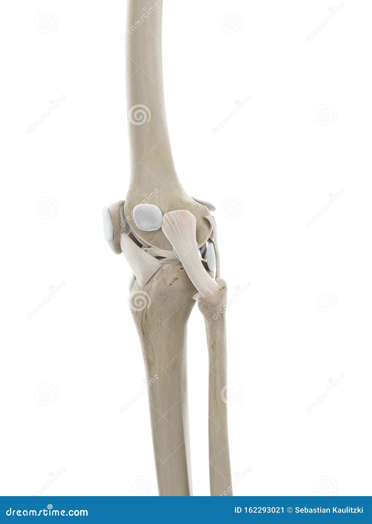 Ligaments Of The Knee_Tear Of The Lateral Collateral Ligament Vector ...