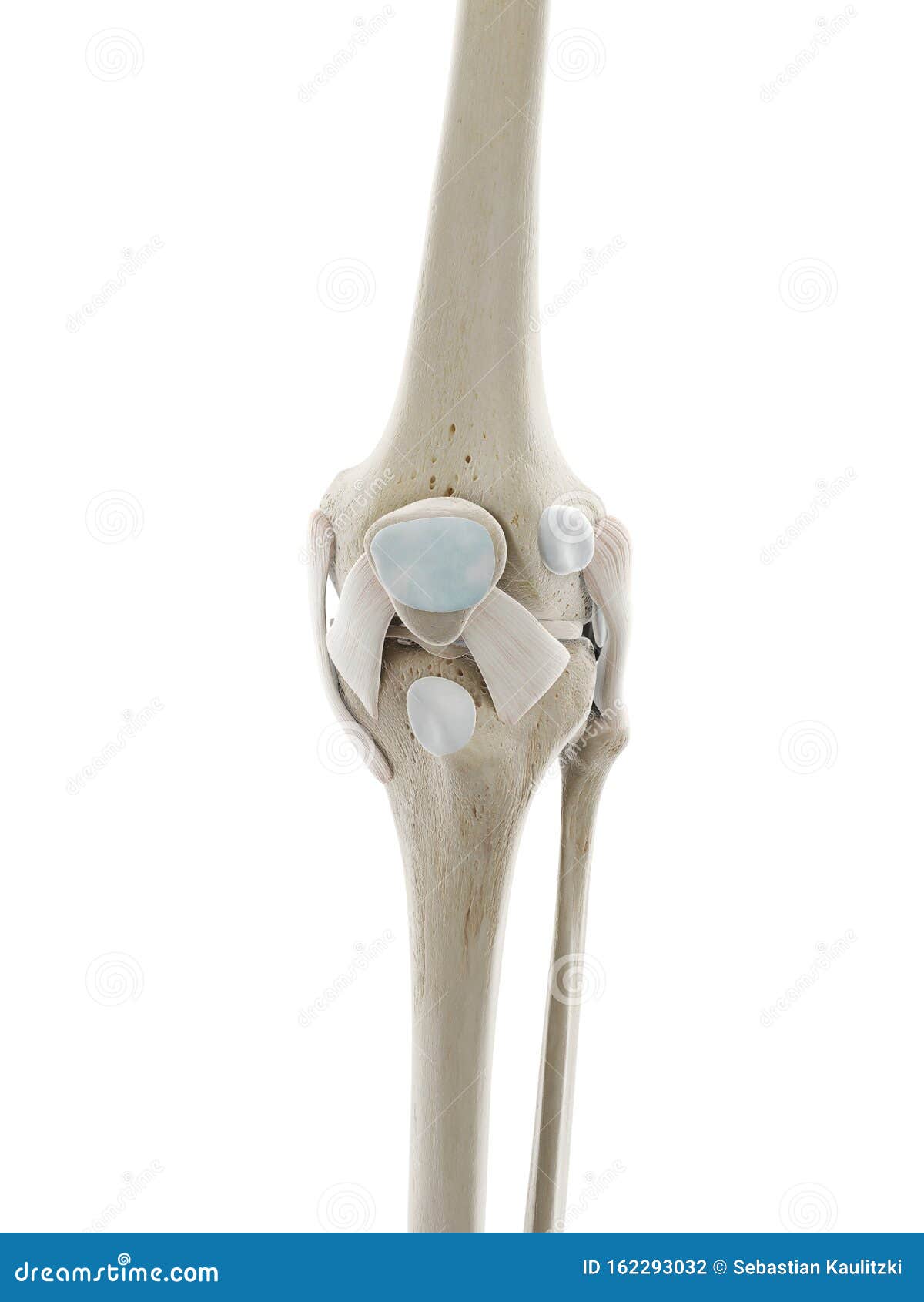 Ligaments Of The Knee_Torn Anterior Cruciate Ligament Vector ...