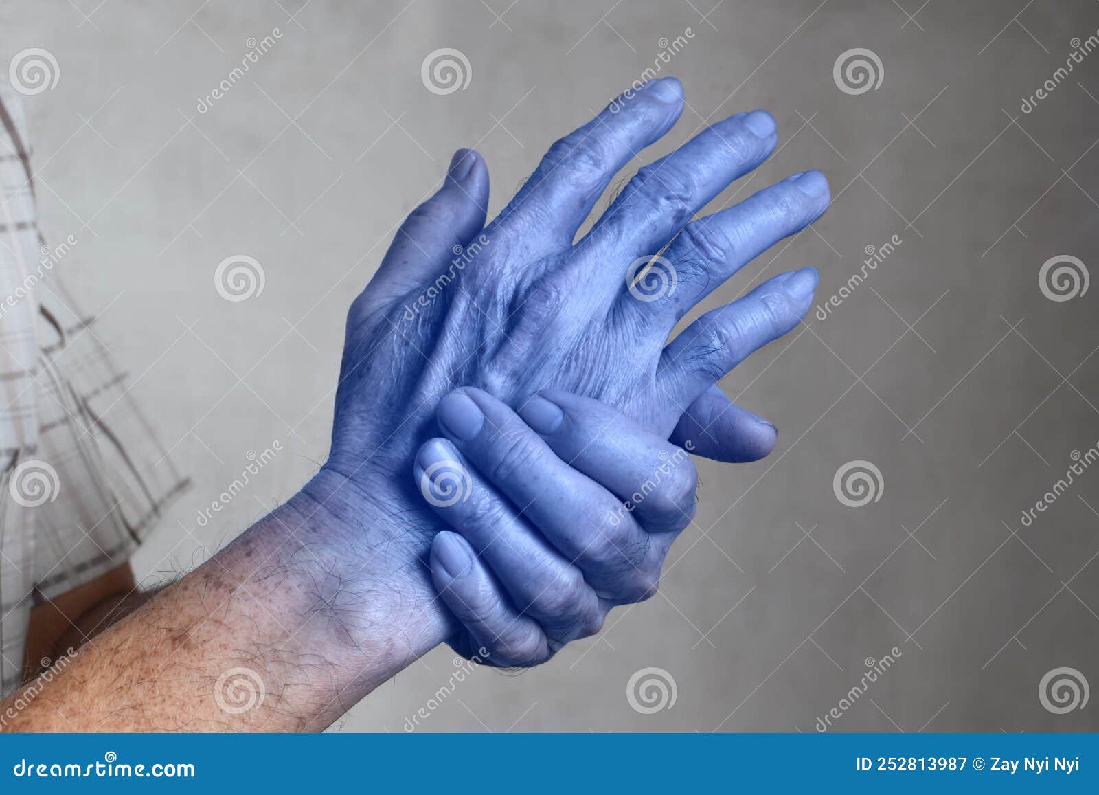 Light Blue Colored Hands of Asian Man. Concept of Cold and Clumsy Hand ...