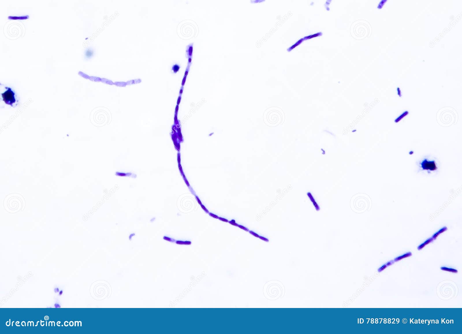 Bacillus Gram Positive Stain Under Microscope View. Bacillus Is Rod ...