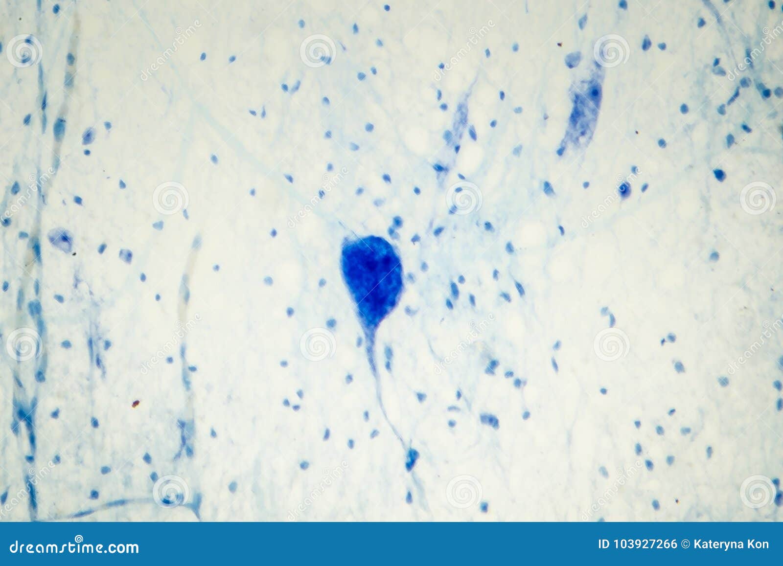 Light Micrograph of Human Brain Tissue Stock Photo - Image of ...