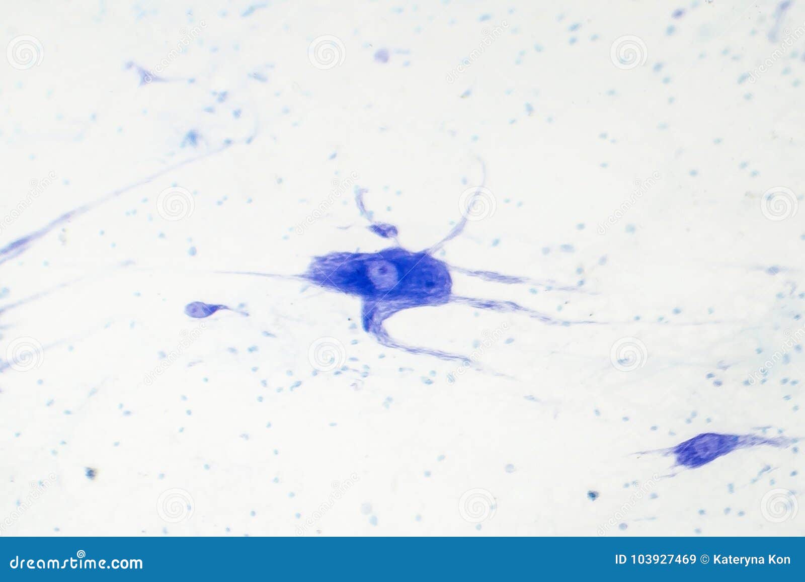 Light Micrograph of Human Brain Tissue Stock Image - Image of ...