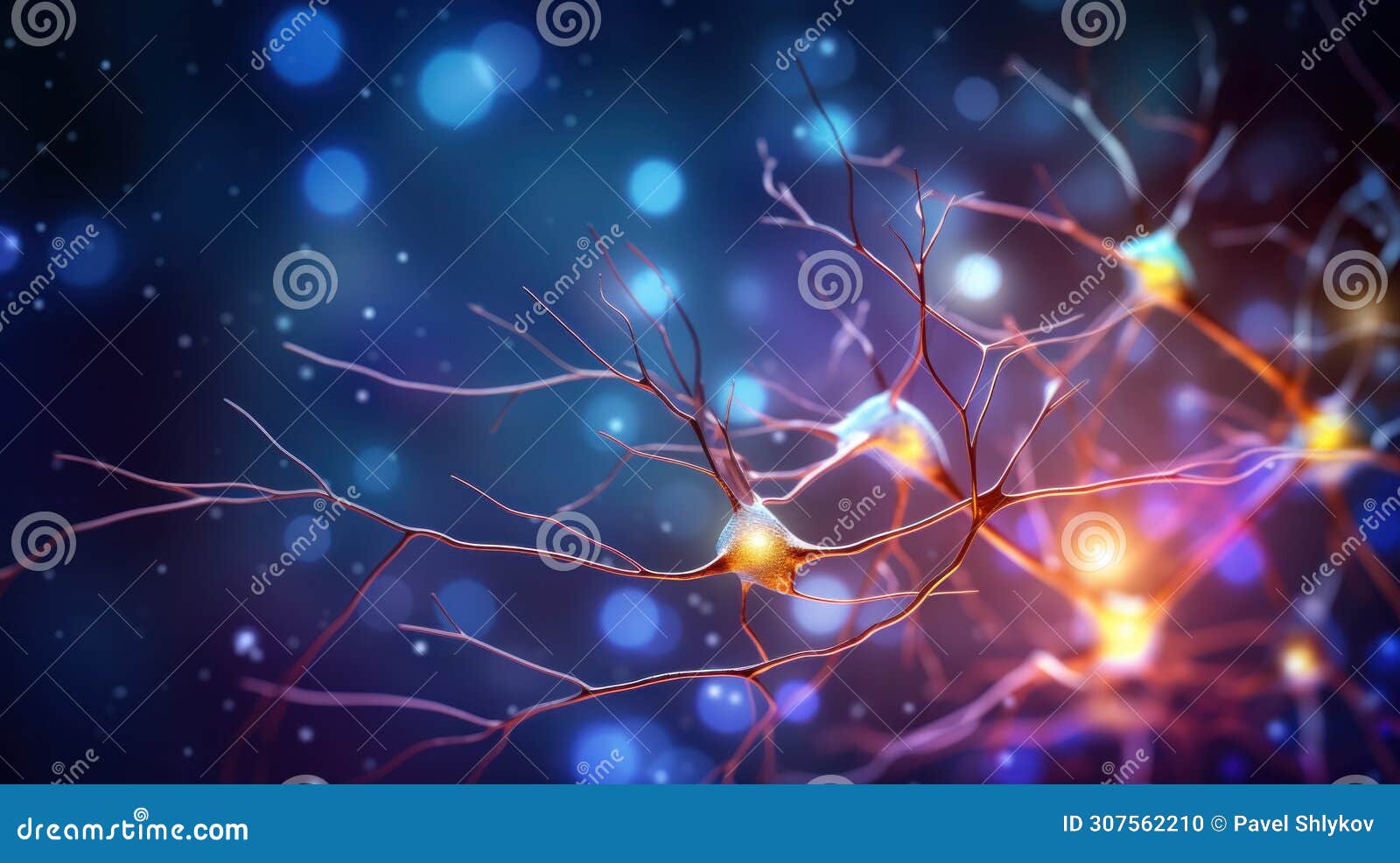 Light Micrograph of Human Brain Tissue Showing Neurons and Glial Cells ...