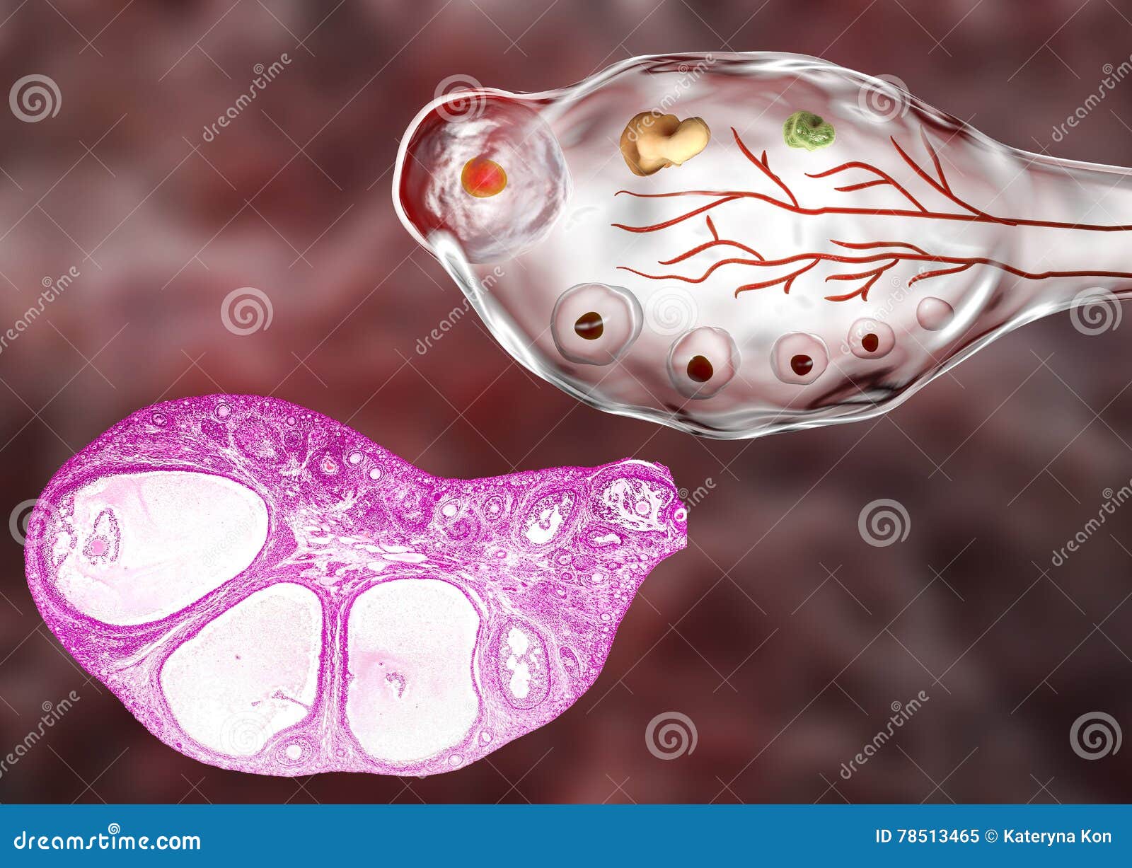 Light Micrograph and Illustration of Ovary Stock Illustration ...