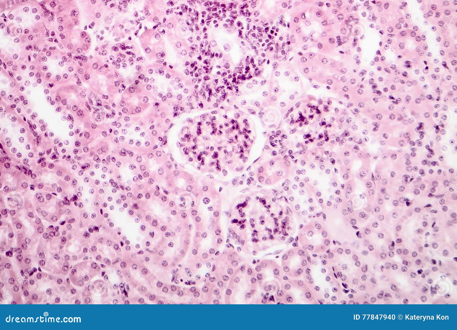 Light Micrograph of a Kidney Stock Photo - Image of crosssection ...