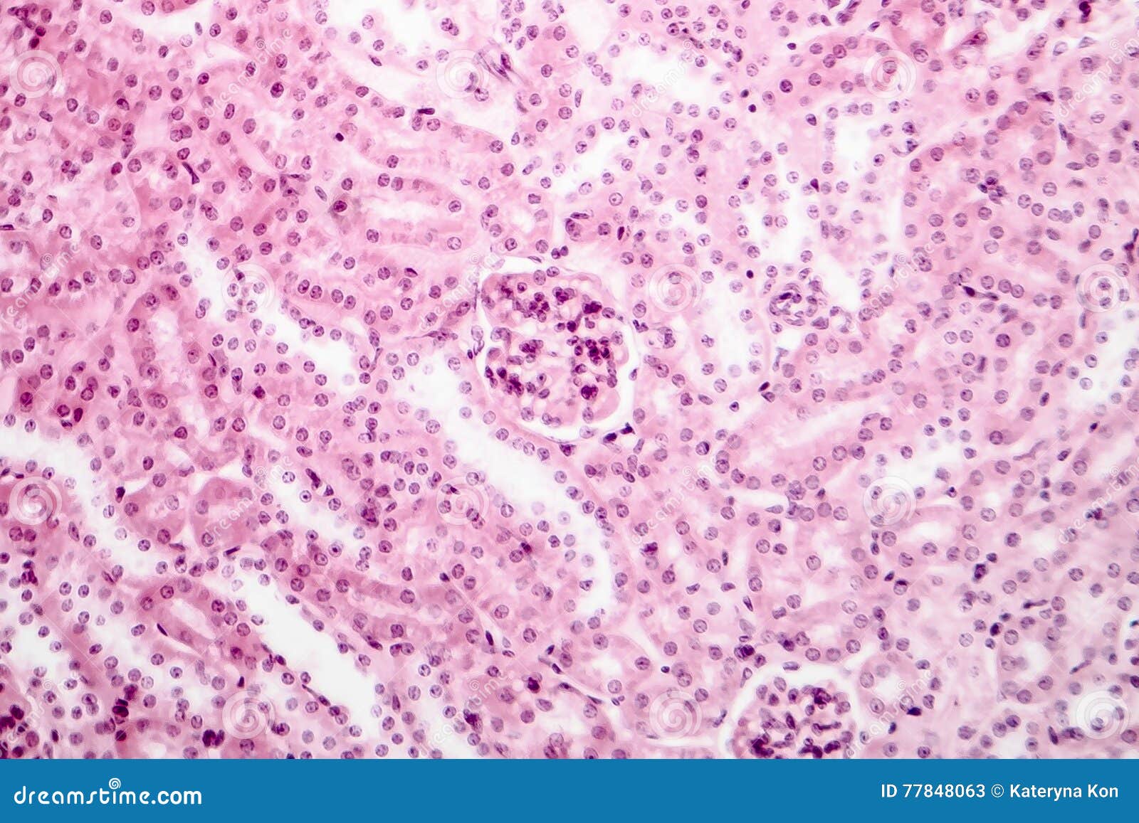Kidney Glomerulus Micrograph Stock Photography | CartoonDealer.com ...