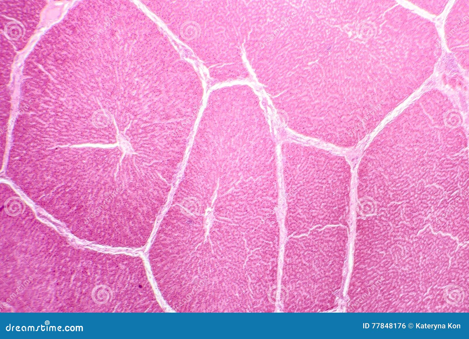 Light Micrograph of a Liver Stock Photo - Image of tissue, hematoxylin ...