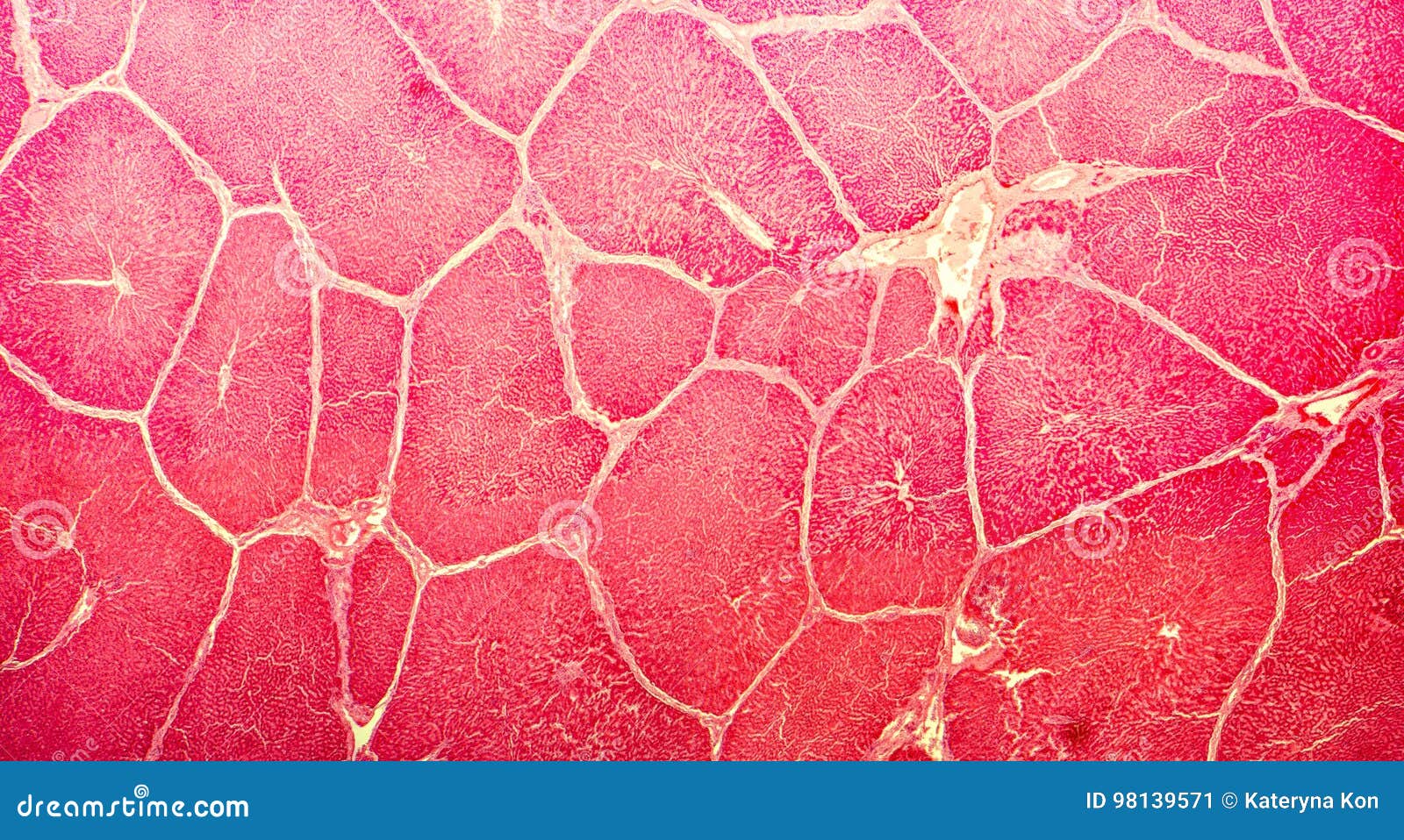 Light Micrograph of a Liver Stock Image - Image of magnification ...