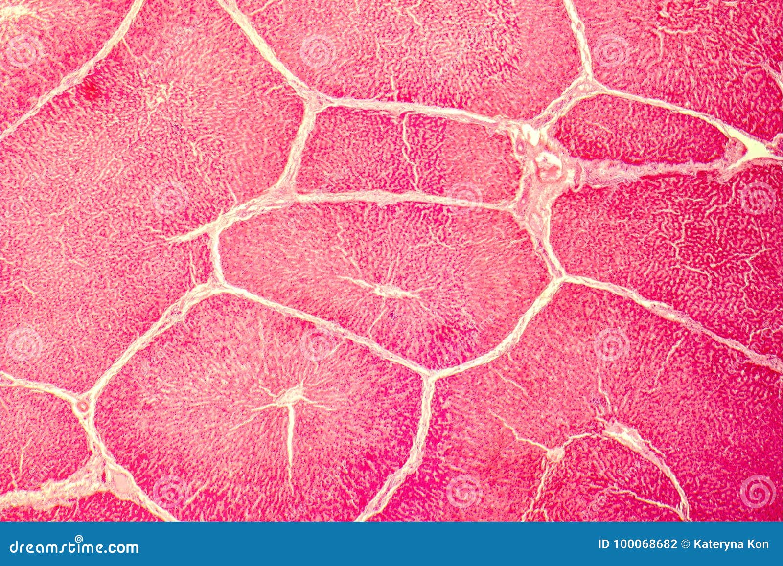 Light Micrograph of a Liver Stock Photo - Image of hepatic, bile: 100068682