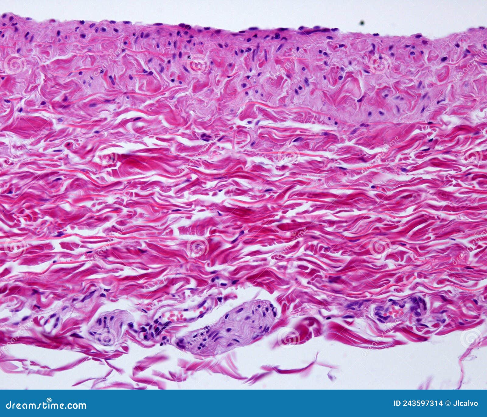 Large vein wall stock photo. Image of histological, circular - 243597314