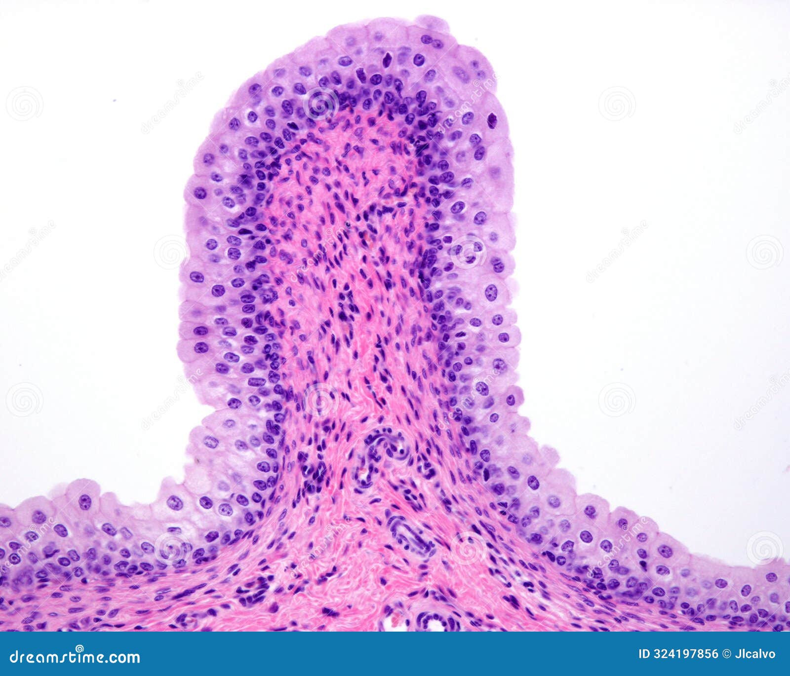 Urinary Bladder. Transitional Epithelium Stock Photo - Image of ...