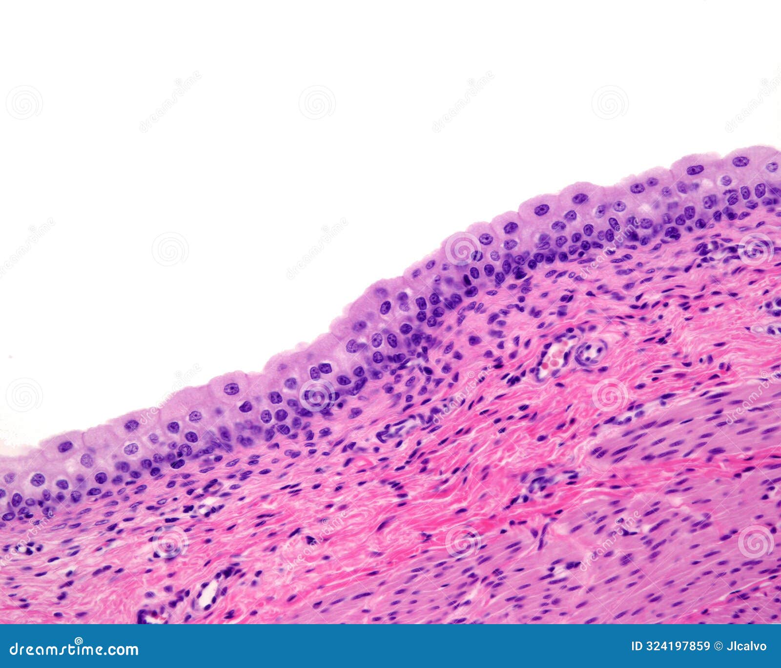 Urinary Bladder. Transitional Epithelium Stock Image - Image of ...